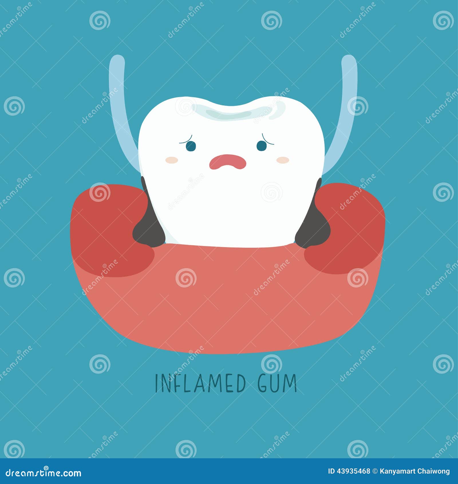 Inflamed Gum of Dental Illustrator Stock Vector - Illustration of level ...