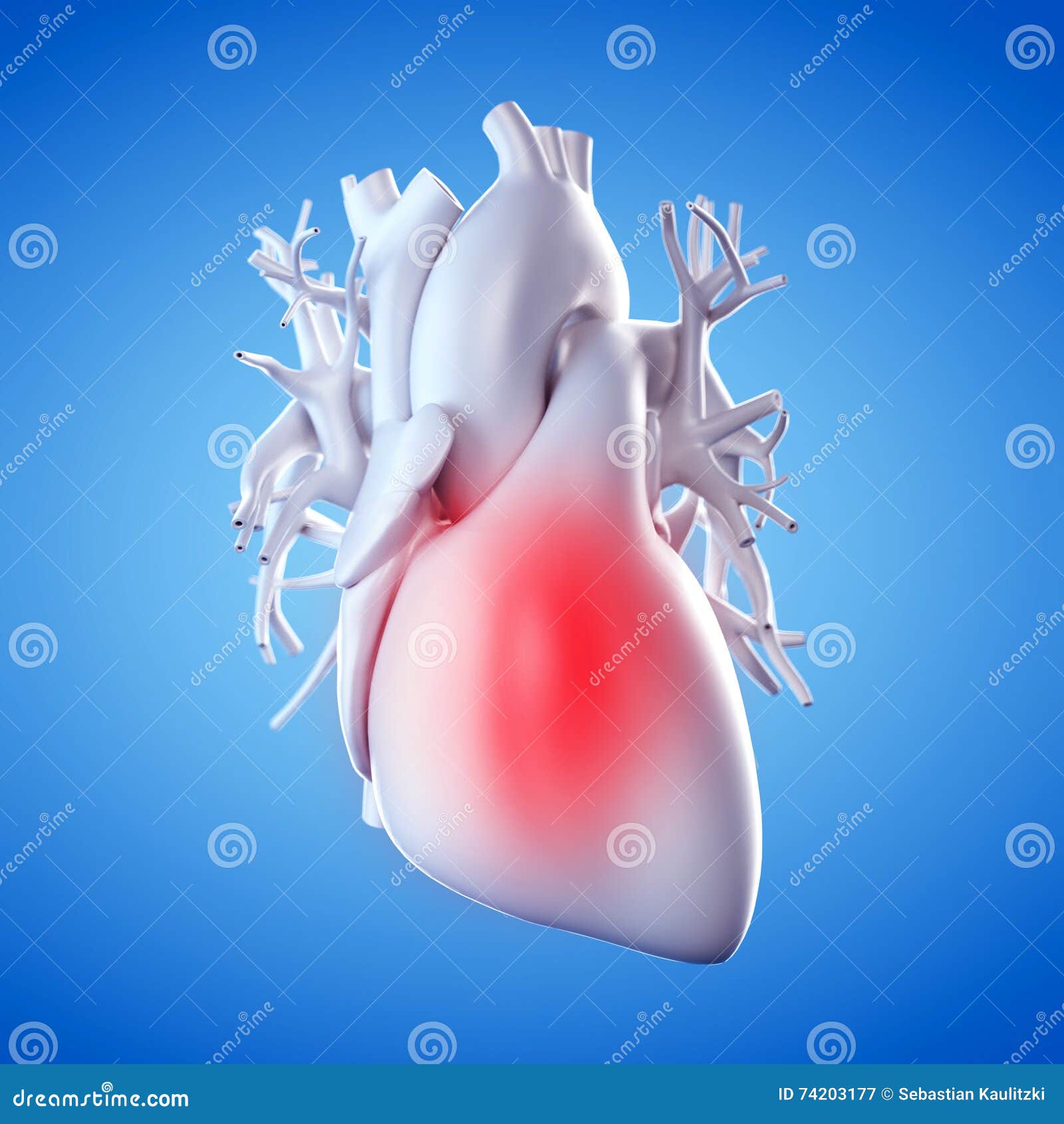 An inflamed heart stock illustration. Illustration of love - 74203177