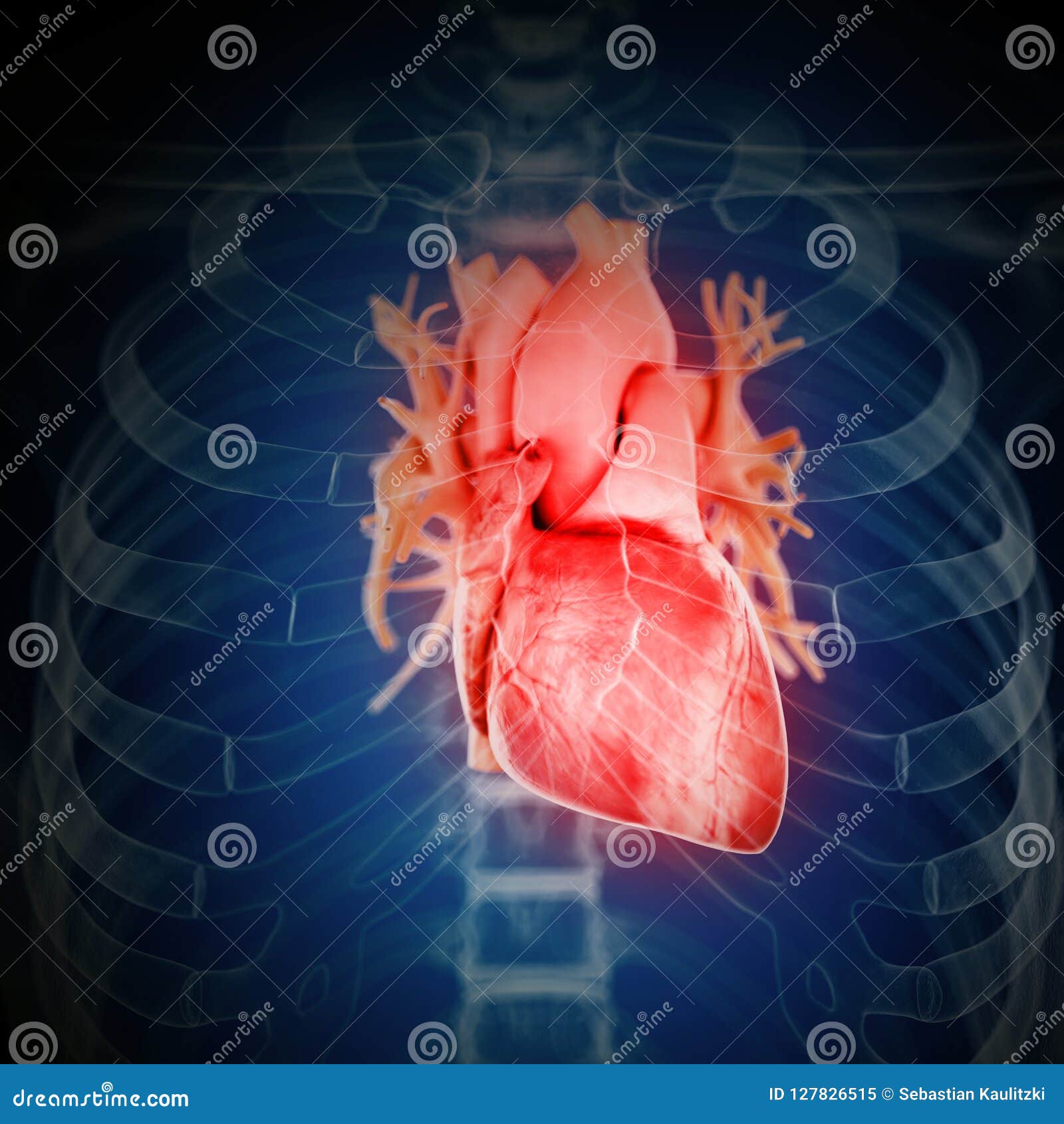 An inflamed heart stock illustration. Illustration of skeletal - 127826515