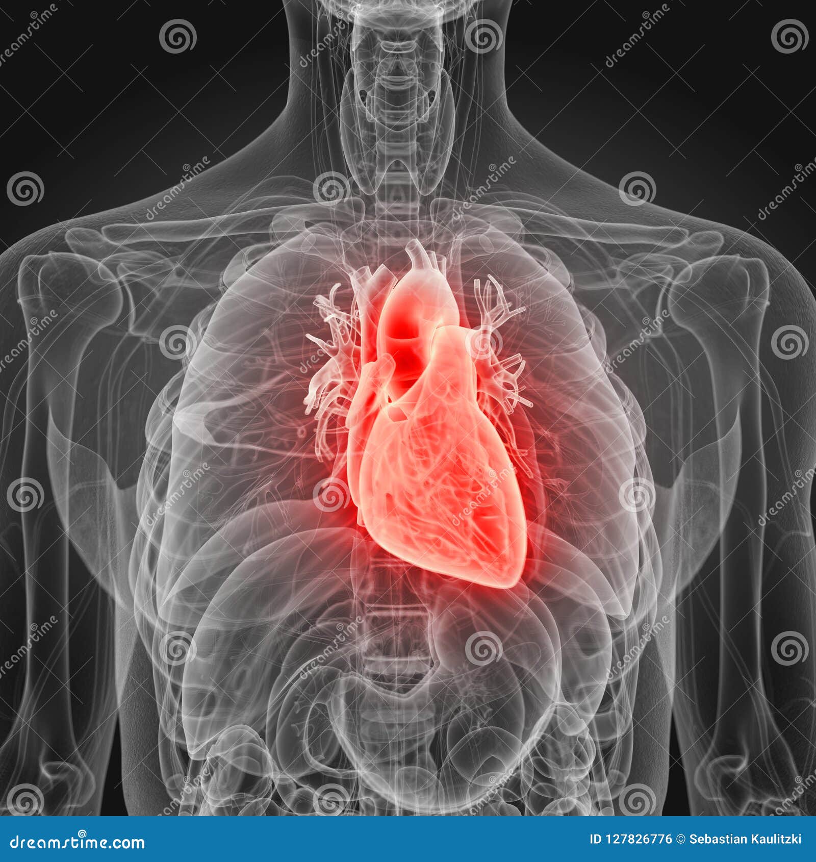 An inflamed heart stock illustration. Illustration of blood - 127826776