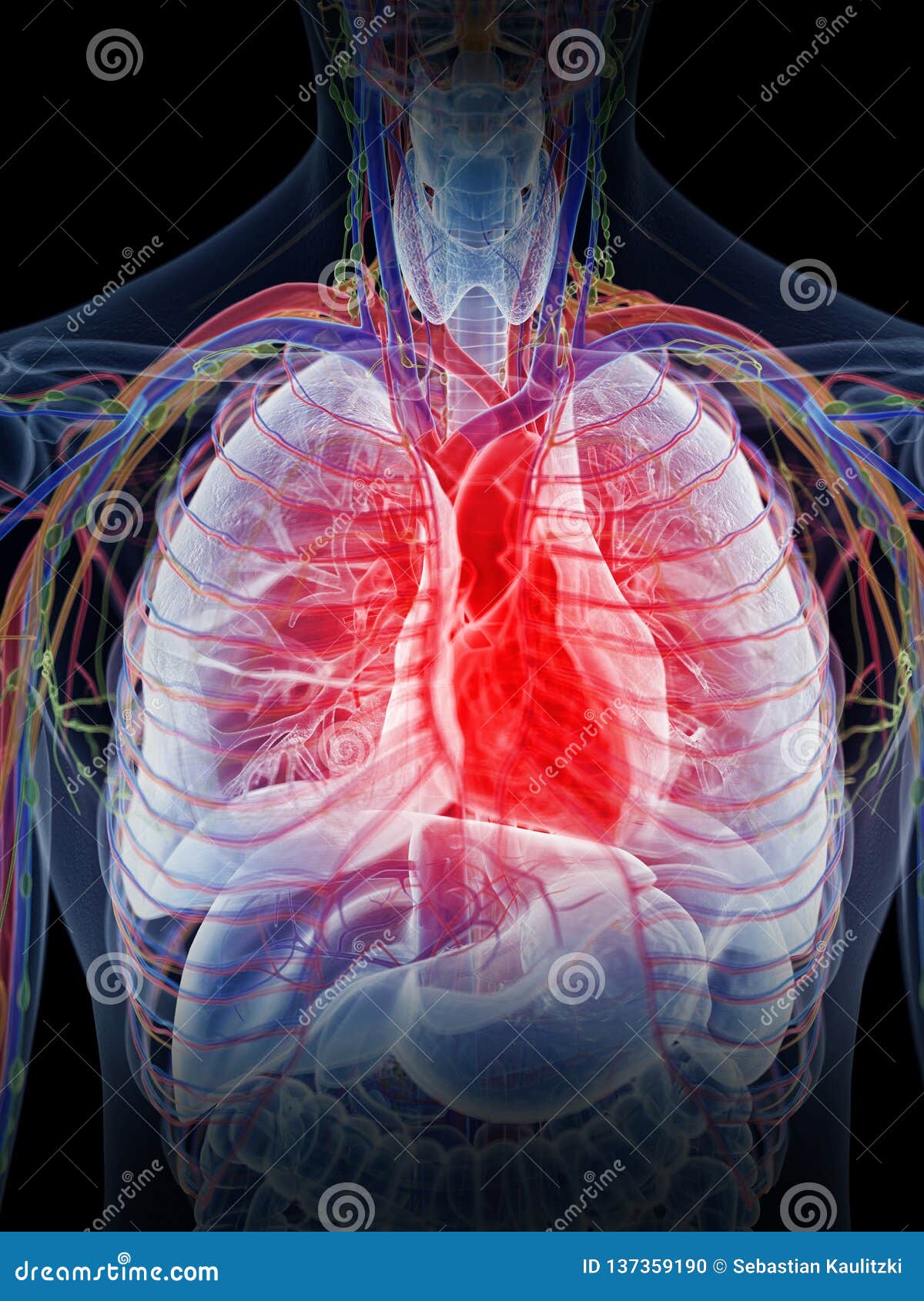 An inflamed heart stock illustration. Illustration of biology - 137359190