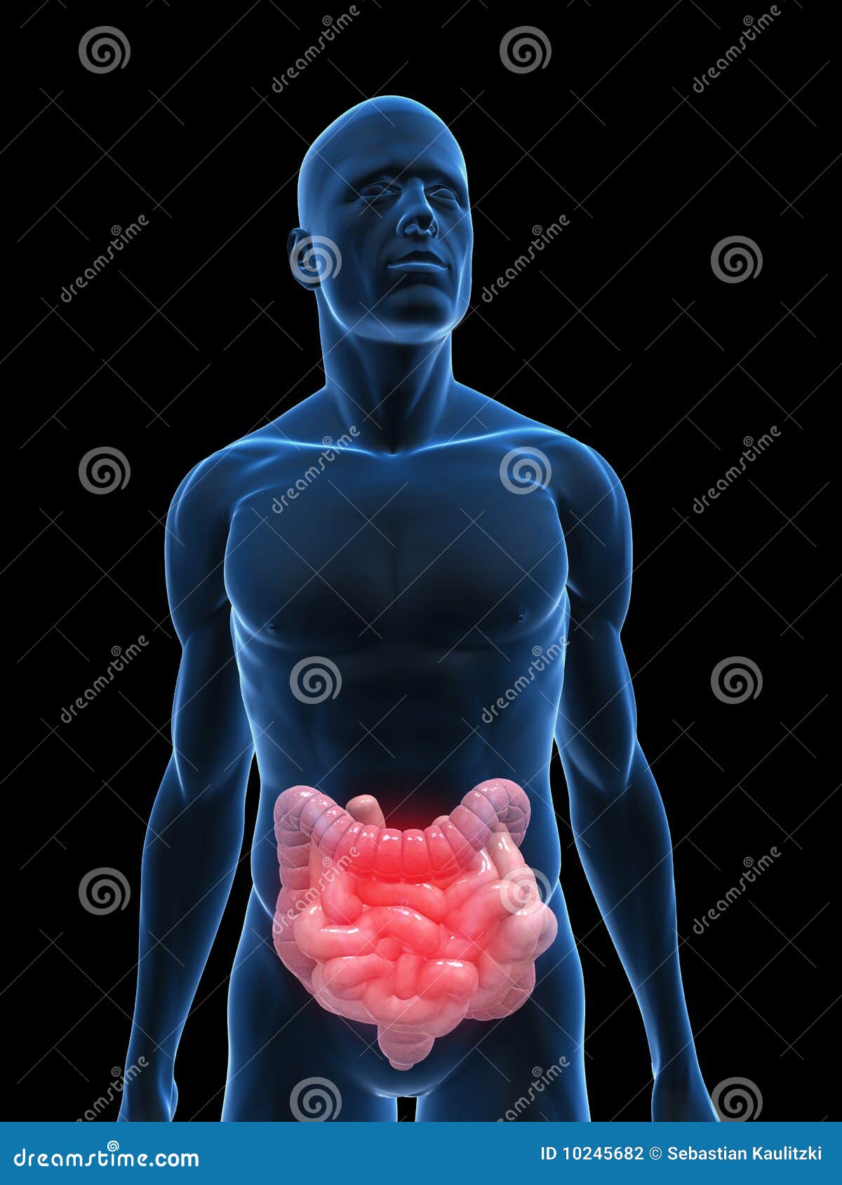 Inflamed intestines stock illustration. Illustration of human - 10245682