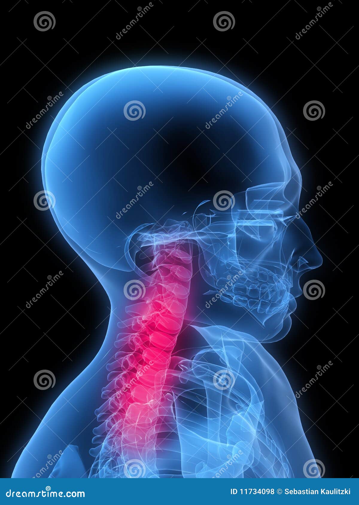 Inflamed neck stock illustration. Illustration of anatomical - 11734098