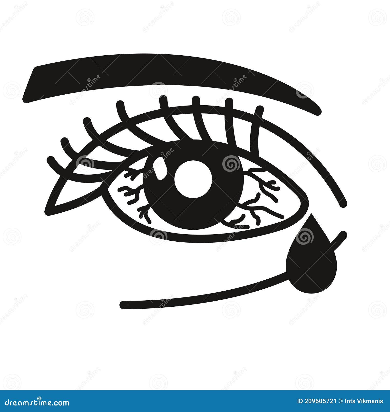 Inflammated Eye Conjunctivitis Or Pink Eye Cartoon Vector ...