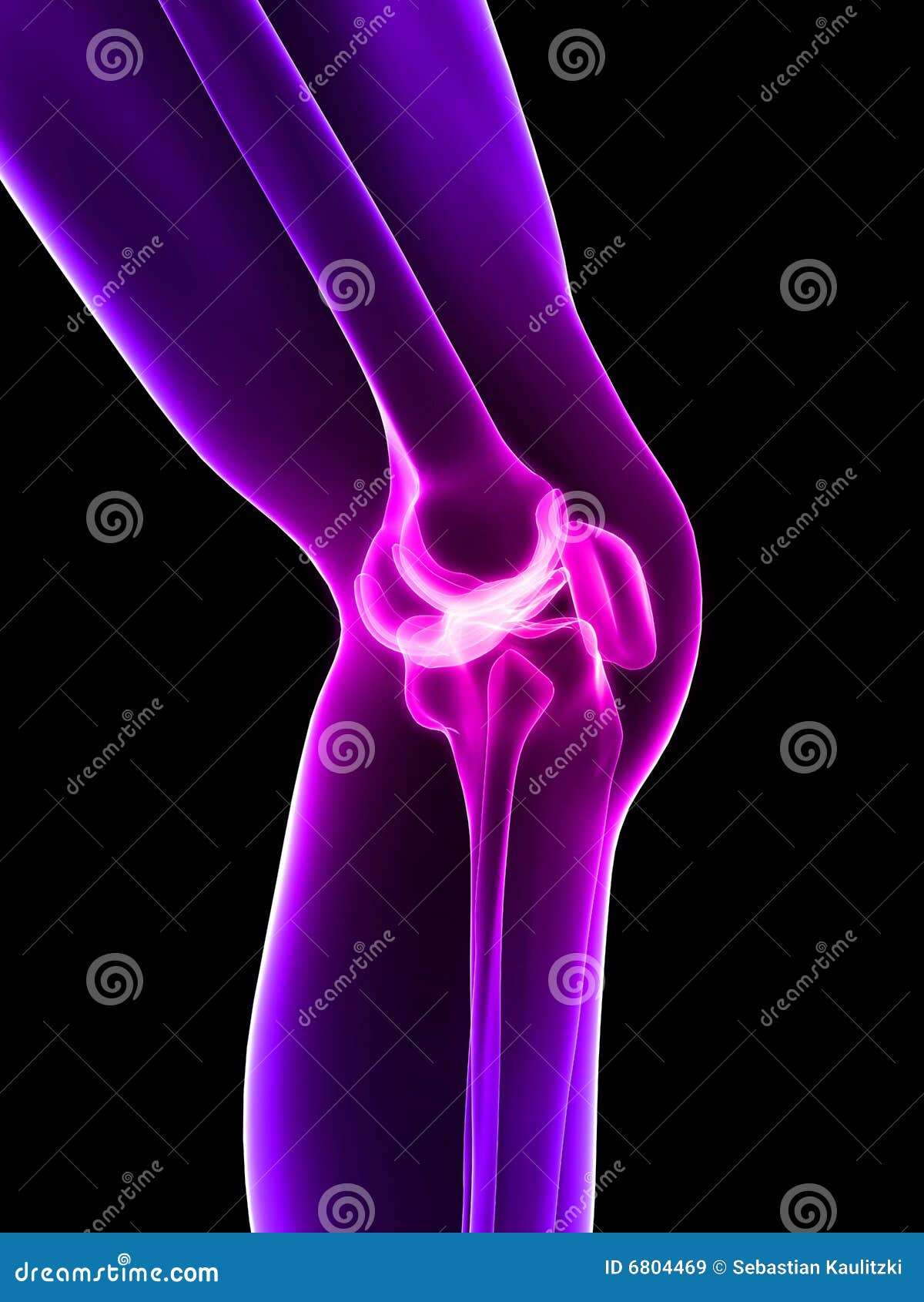 Inflammated knee stock illustration. Illustration of backbone - 6804469
