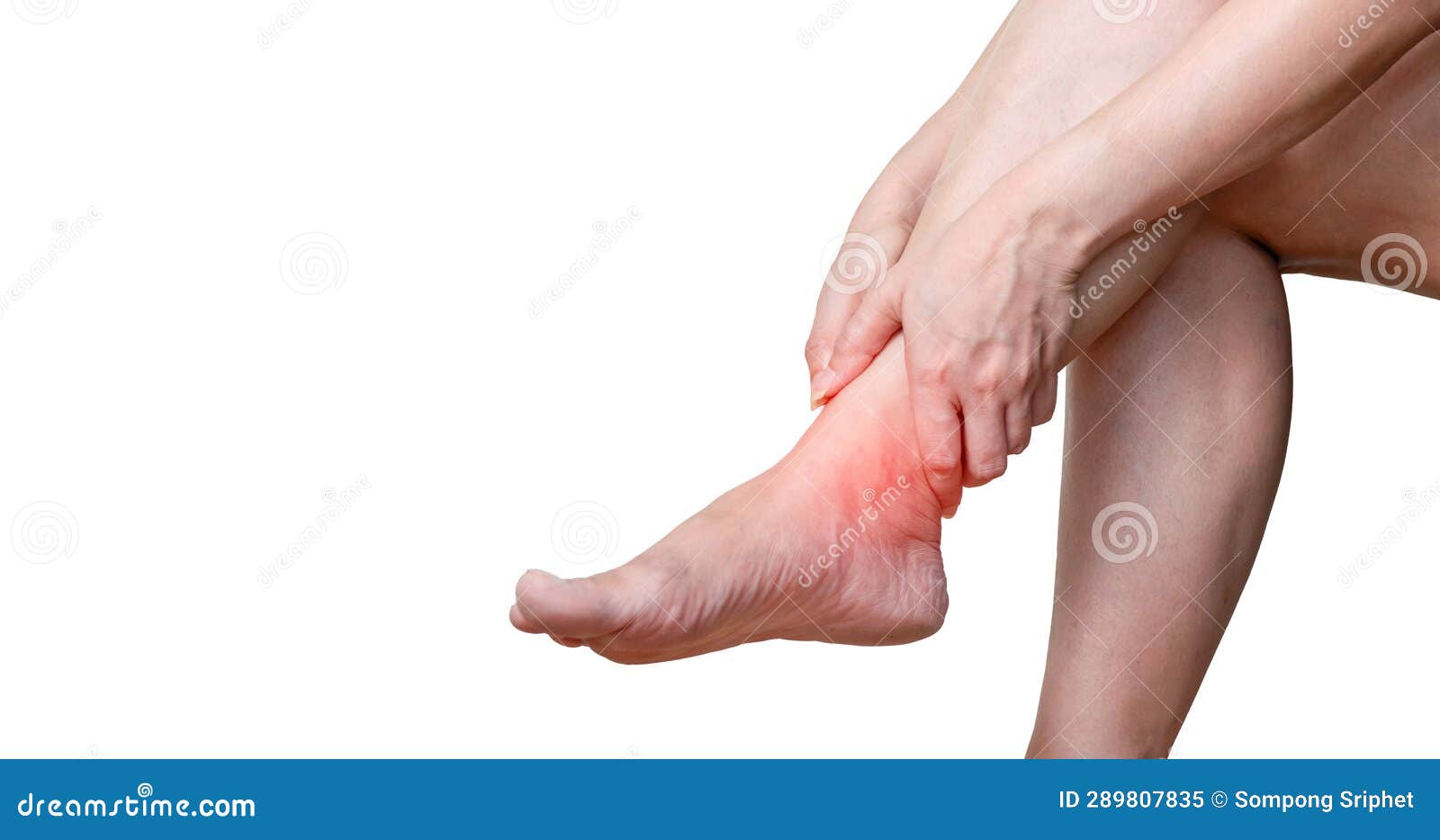 Inflammation of the Ankle Bones Human Stock Image - Image of healthy ...