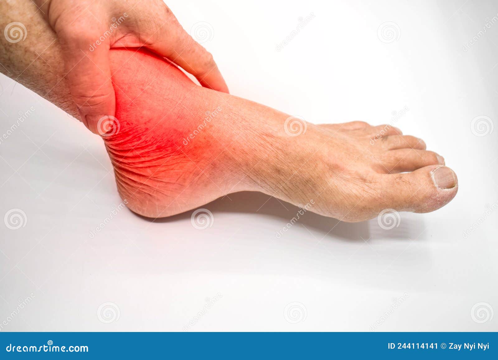 Inflammation of Ankle Joint and Foot. Concept of Joint Pain and Leg ...