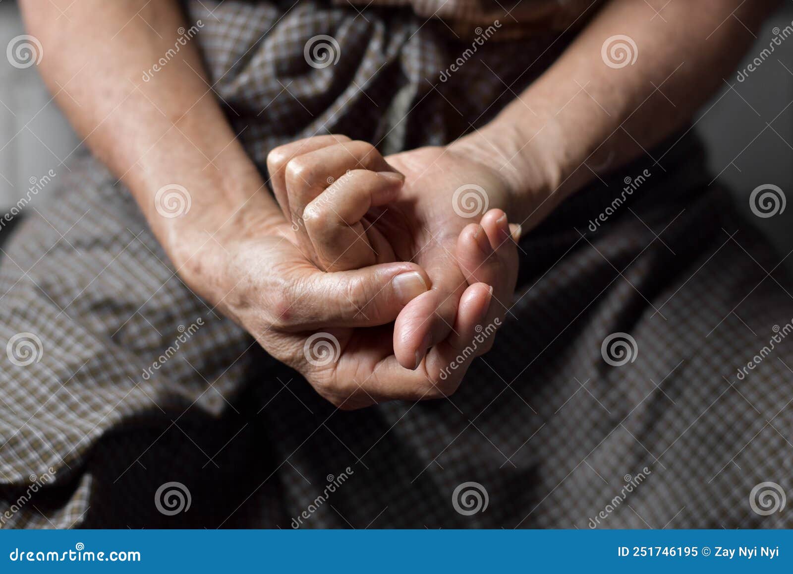 Inflammation of Asian Man Thumb. Concept of Painful Digit, Cellulitis ...