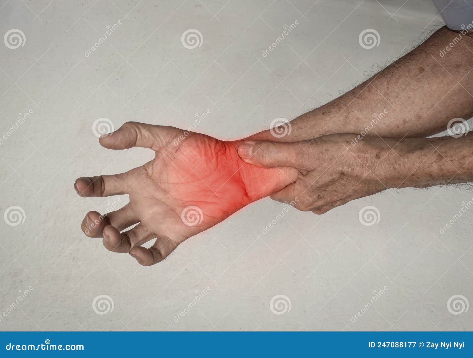 Inflammation of Asian Man Wrist Joint. Concept of Joint Pain and Hand ...