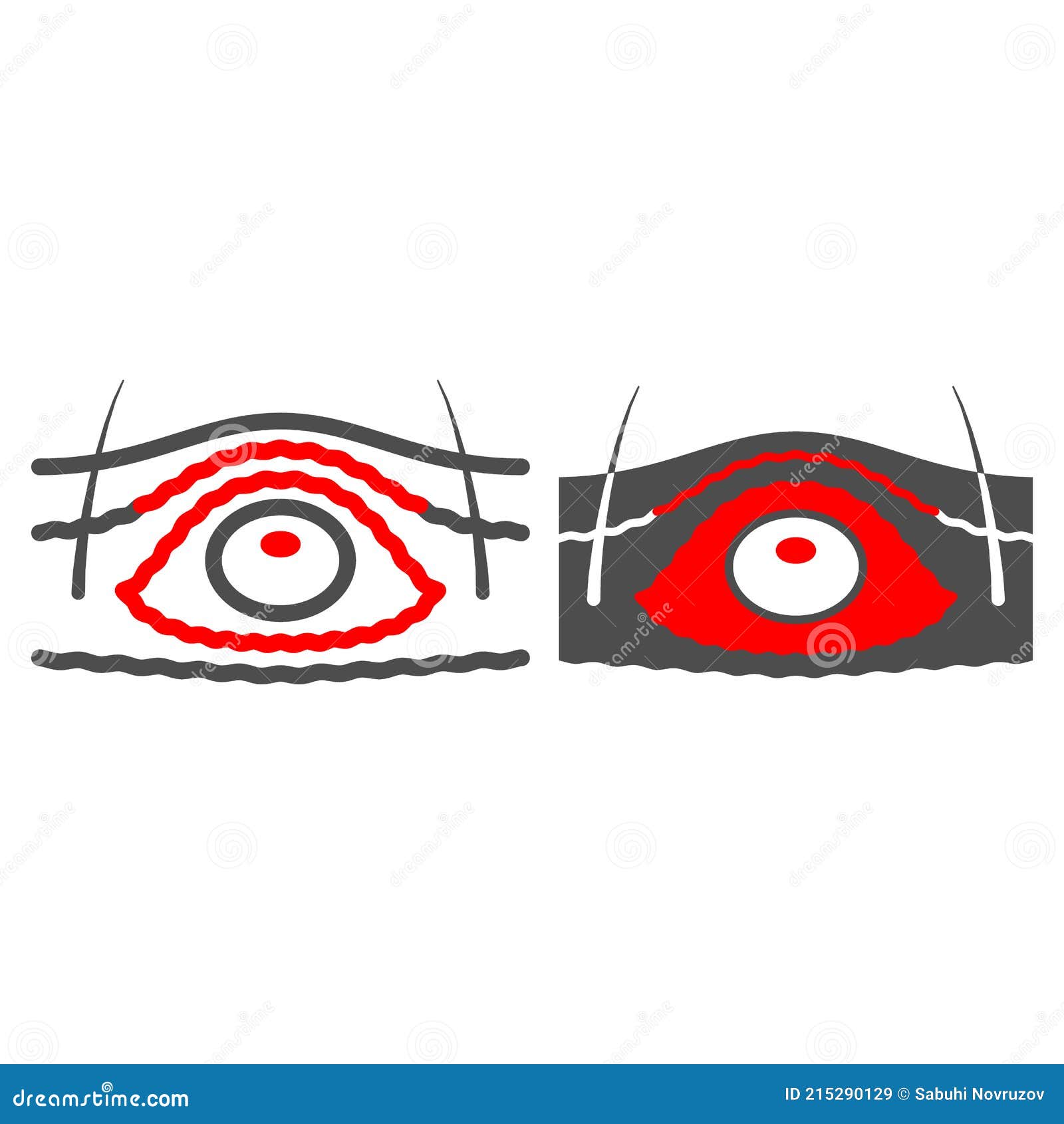 Inflammation Of Connective Tissue Solid Icon, Human Diseases Concept ...