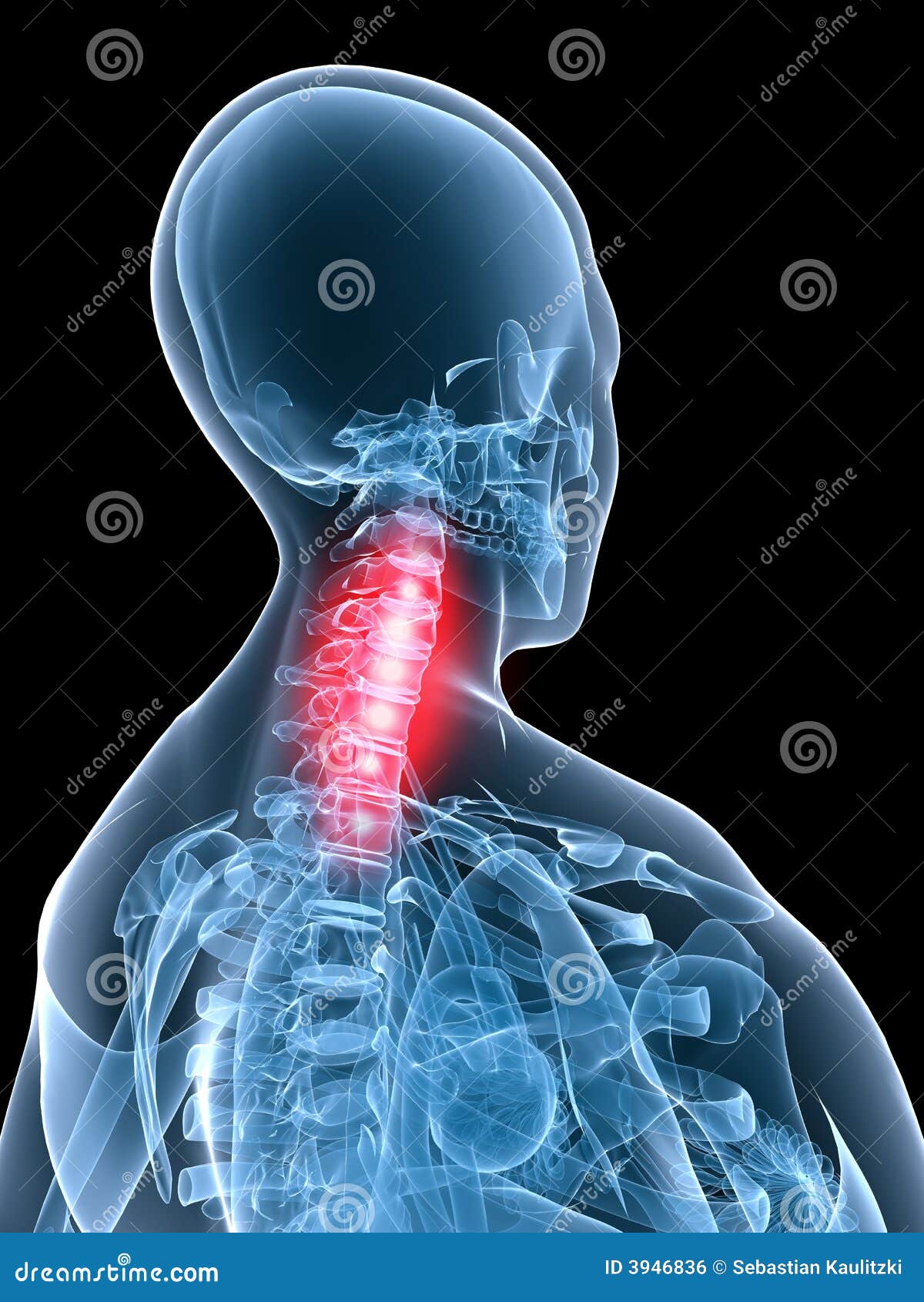 Inflammation D'anatomie-cou De Rayon X Illustration Stock ...