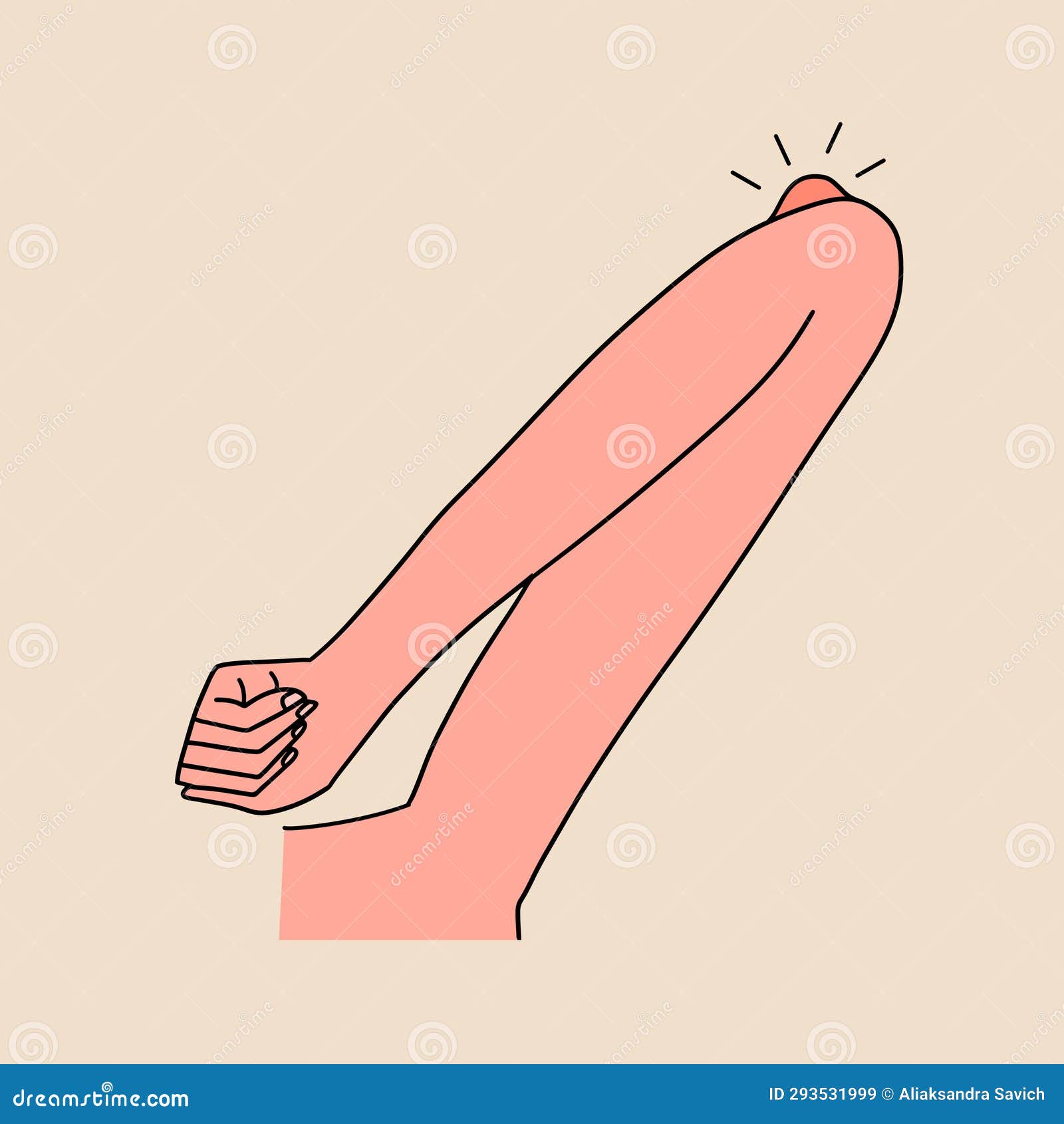 Inflammation of the Elbow Joint, Bursitis, Trauma, Infection, Arthritis ...