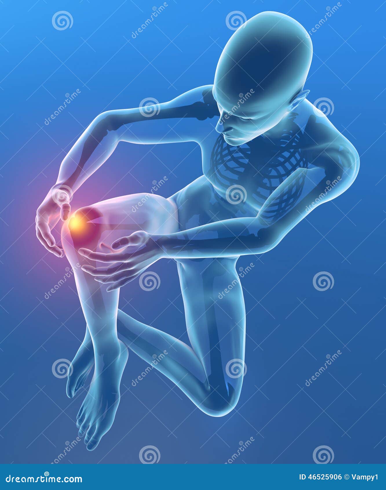 Inflammation of Knee Pain Skeleton X-ray Stock Illustration ...