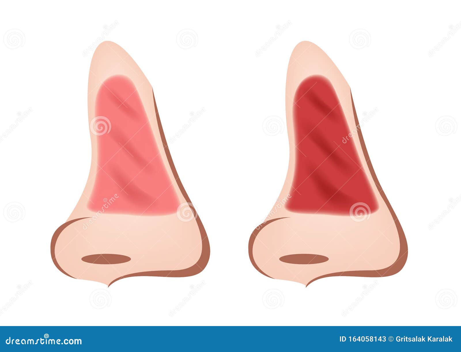 Nasal Mucosa Anatomy. Nasal Mucous Membrane Lining The Respiratory ...