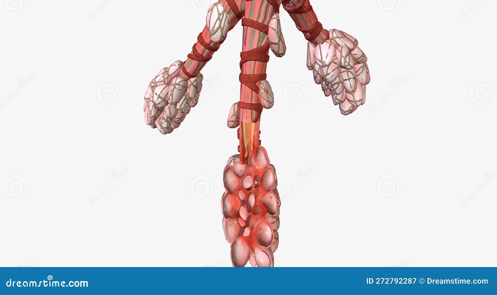 Inflammation and Obstruction of Small Airways Stock Illustration ...