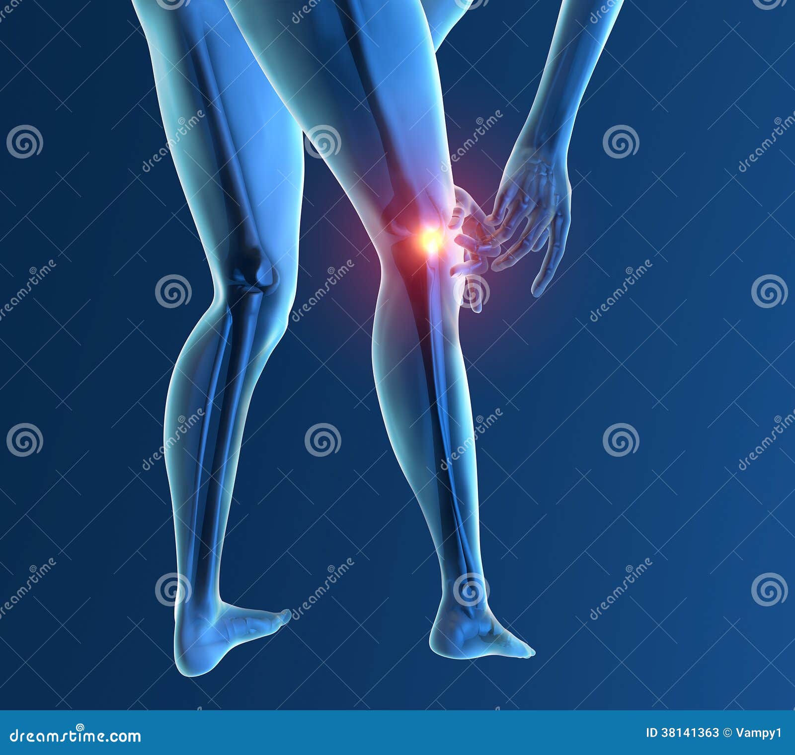 Inflammation Pain Knee Skeleton X-ray Stock Illustration - Illustration ...
