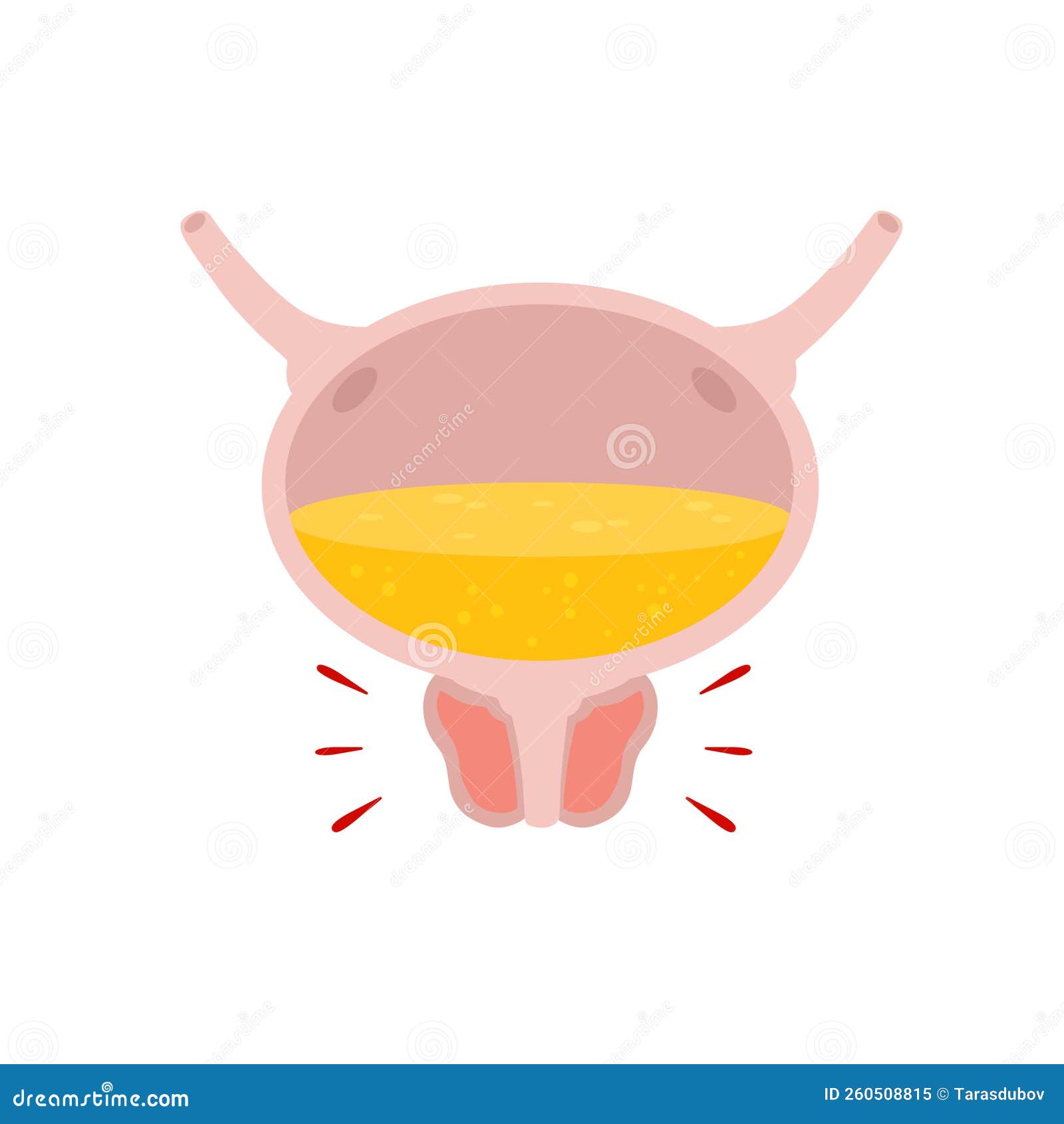 Inflammation of Prostate. Scheme of Health and Bladder Problems Stock ...