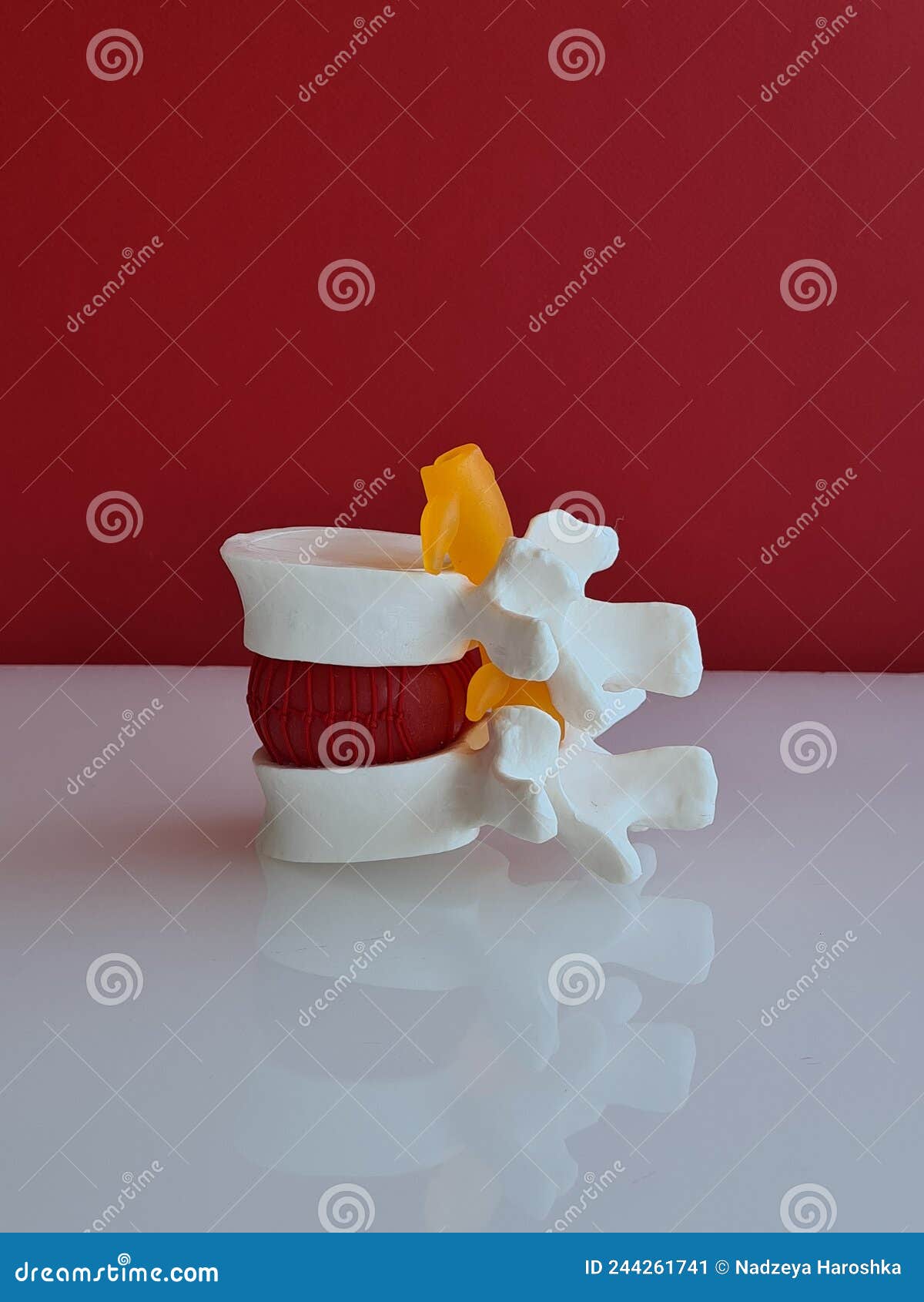 Inflammation and Soreness of Herniated Discs and Other Displaced Joints ...