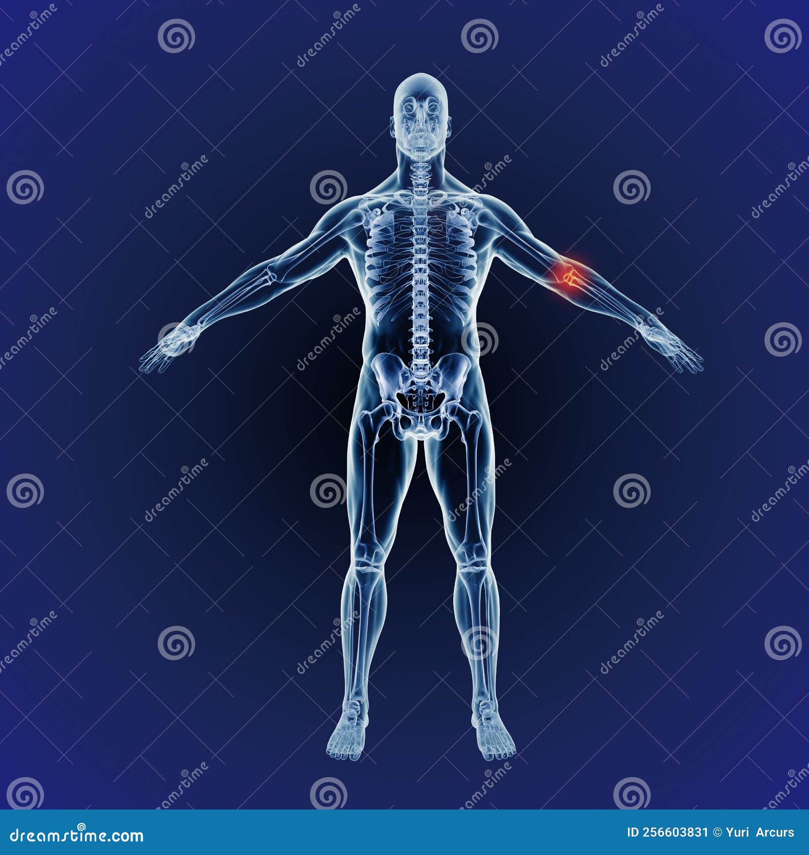 When Inflammation Strikes. a Full Length Cgi Representation of the ...