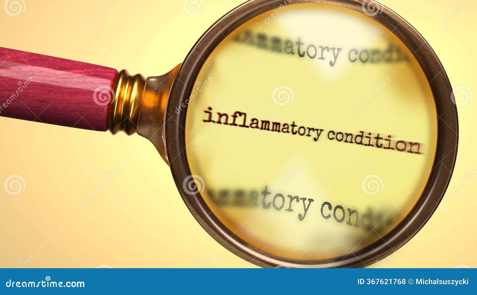 Inflammatory Condition Of Lungs. Human Internal Organ Black Icon ...