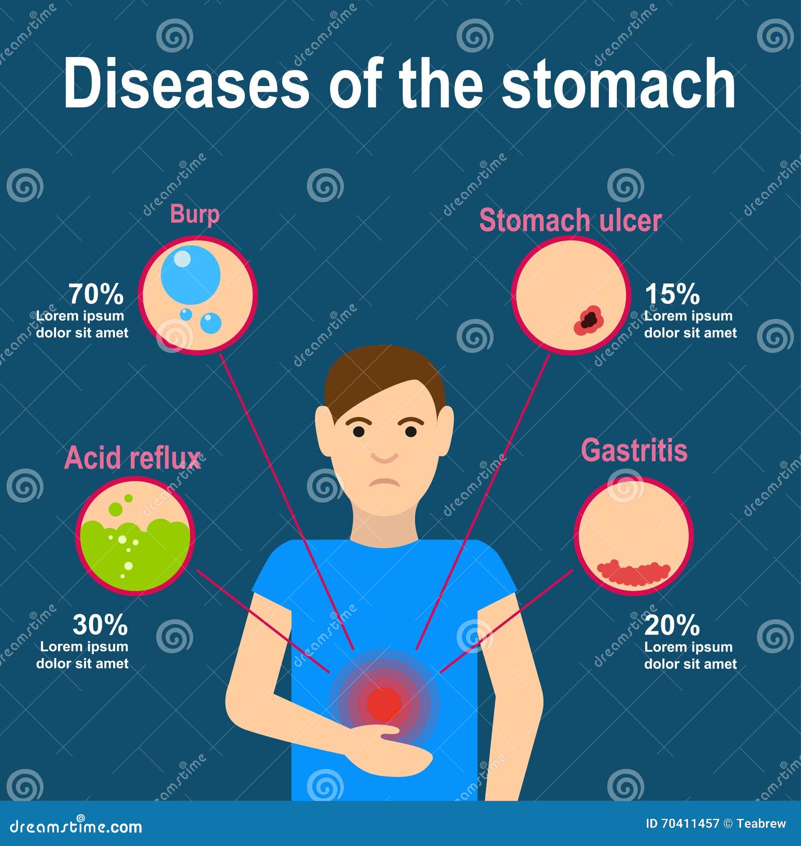 Infografics Del Dolor De Estómago Ilustración del Vector - Ilustración ...