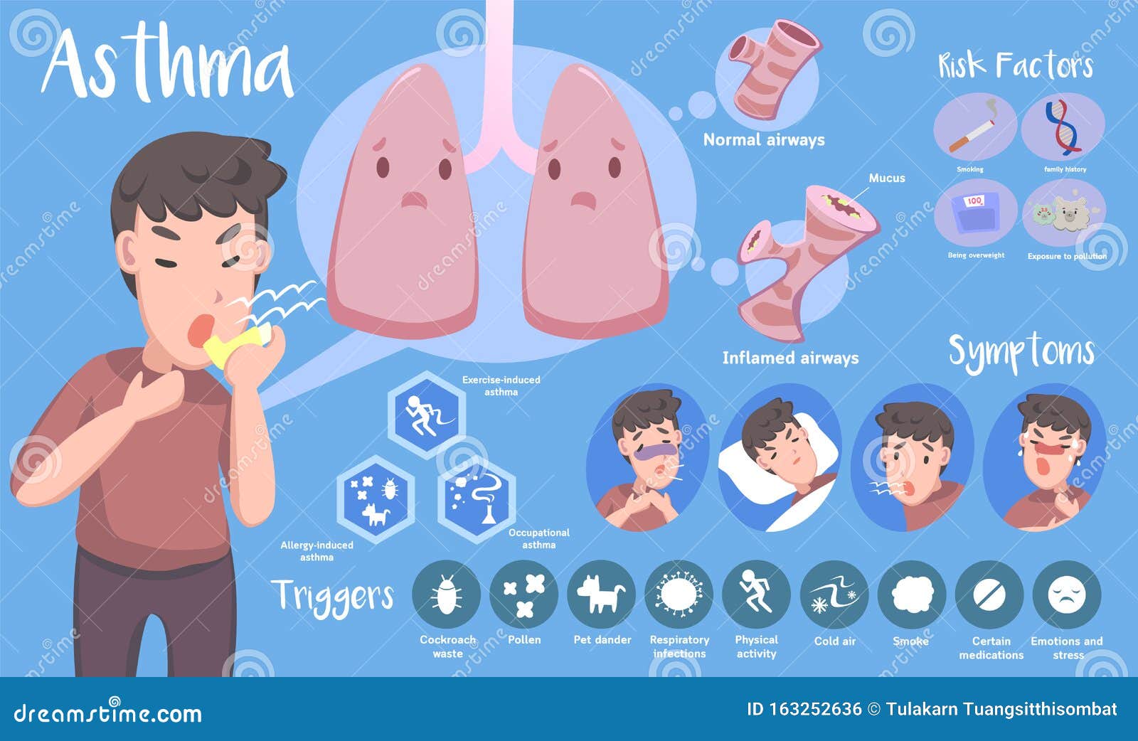 Infographic of Asthma stock vector. Illustration of airway - 163252636