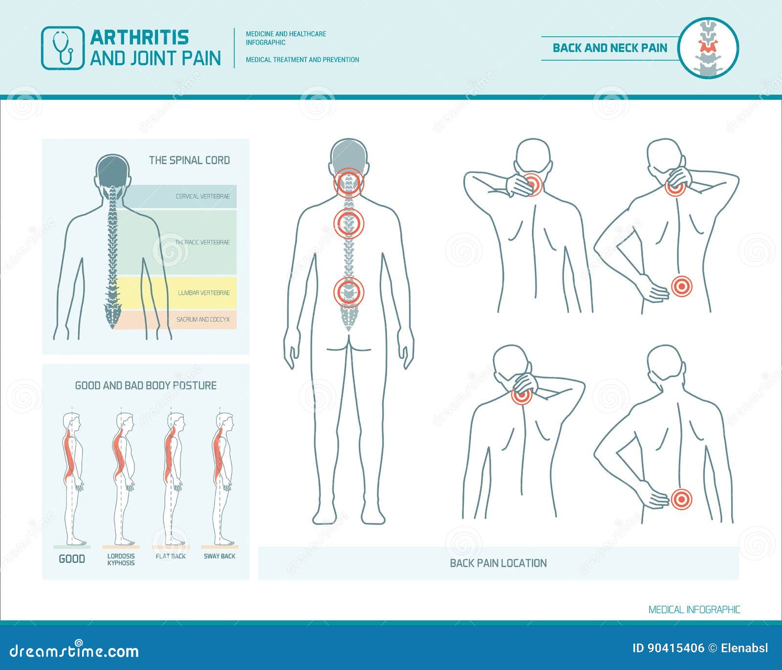 Infographic rugpijn vector illustratie. Illustration of orthopedisch ...