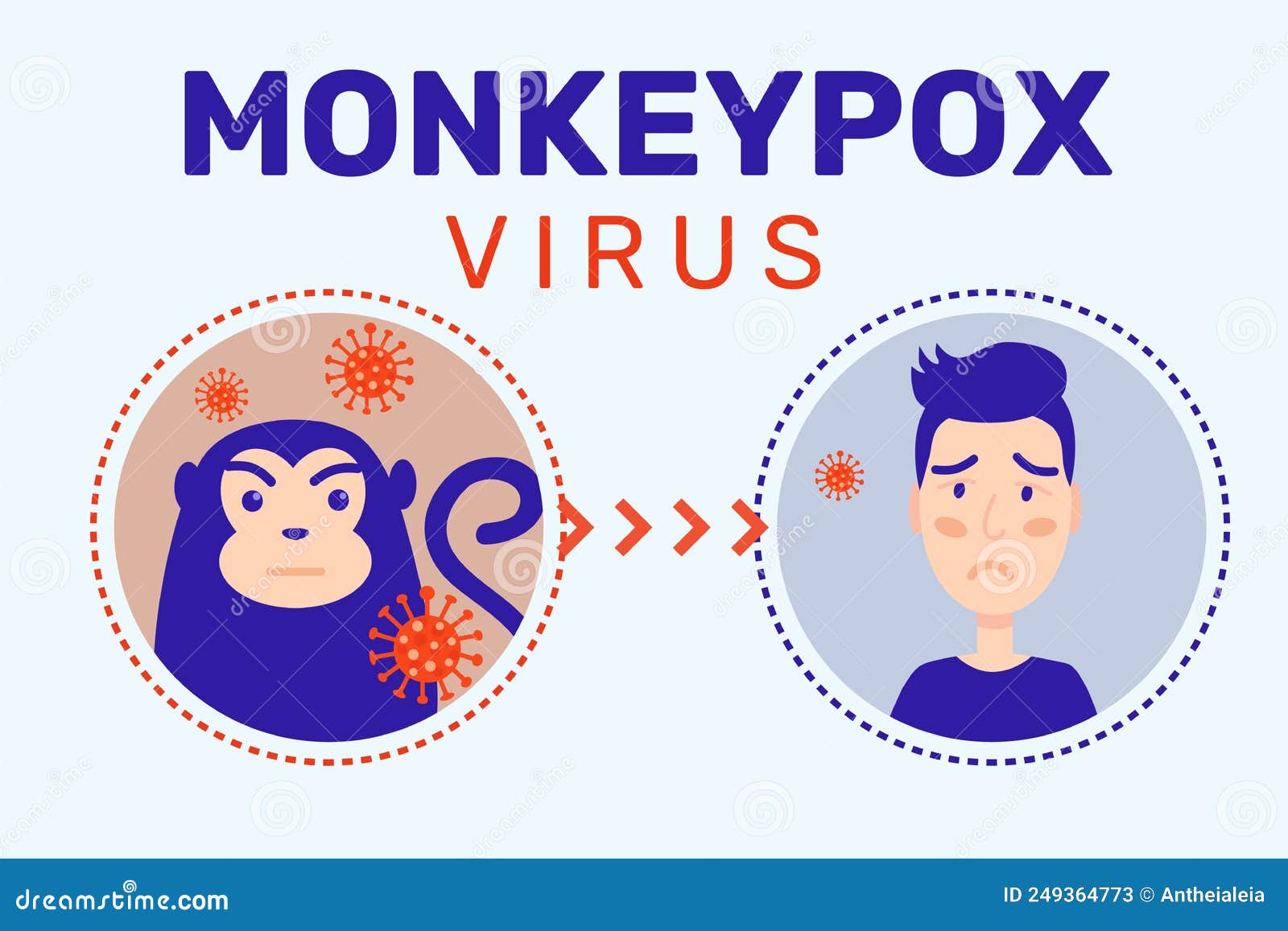 Infographic of Showing Monkey Pox Outbreak. Monkeypox Virus. Stock ...