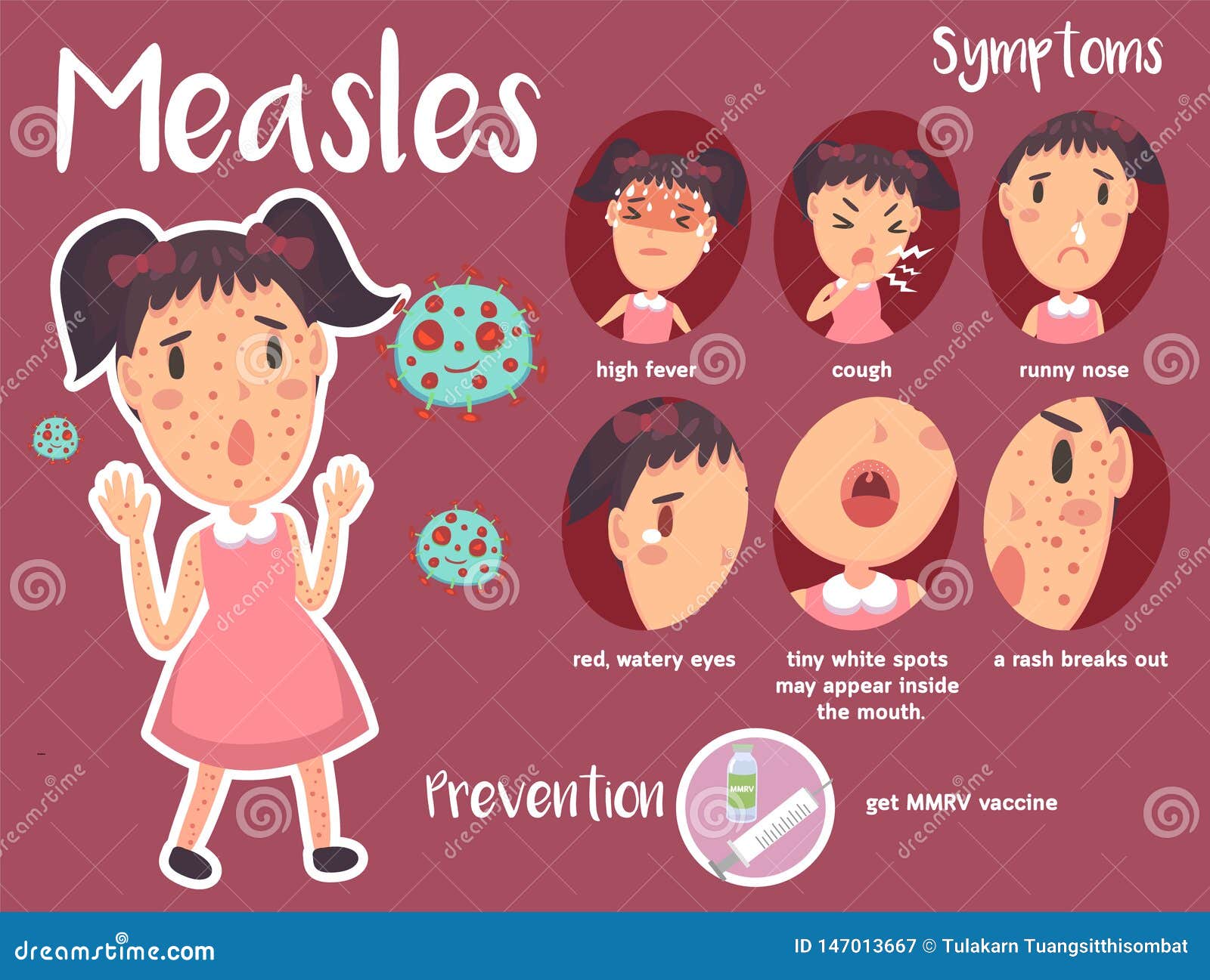 Infographic von Masern vektor abbildung. Illustration von krankheit ...