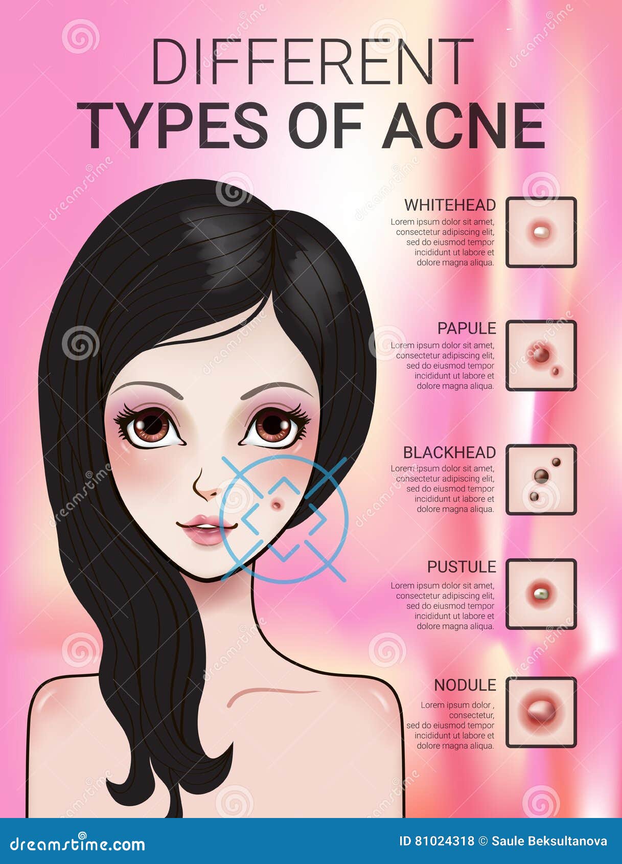 Infographics Of Skin Problems The Causes Of Problem Skin Types Of