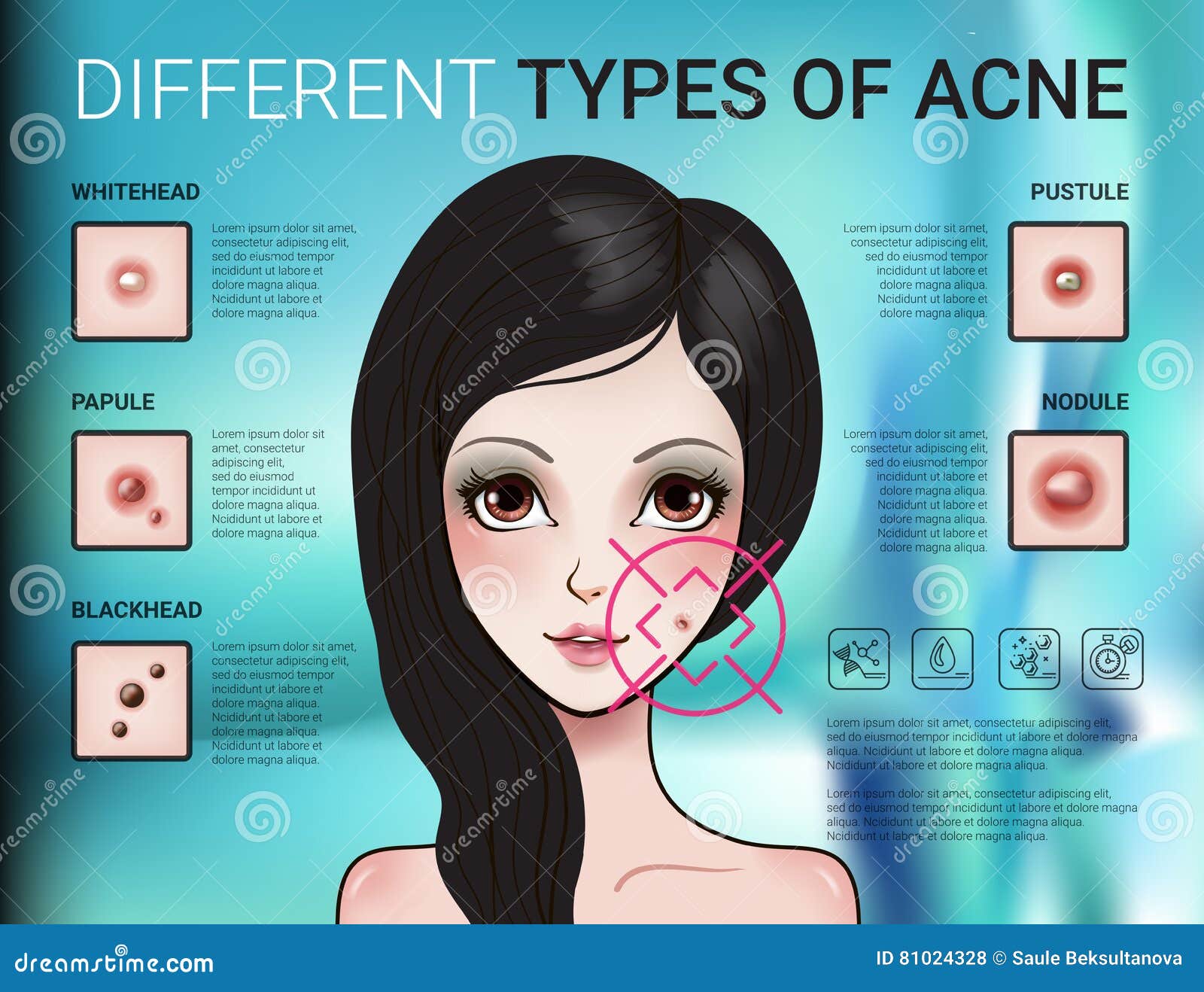 Infographics Of Skin Problems The Causes Of Problem Skin Types Of