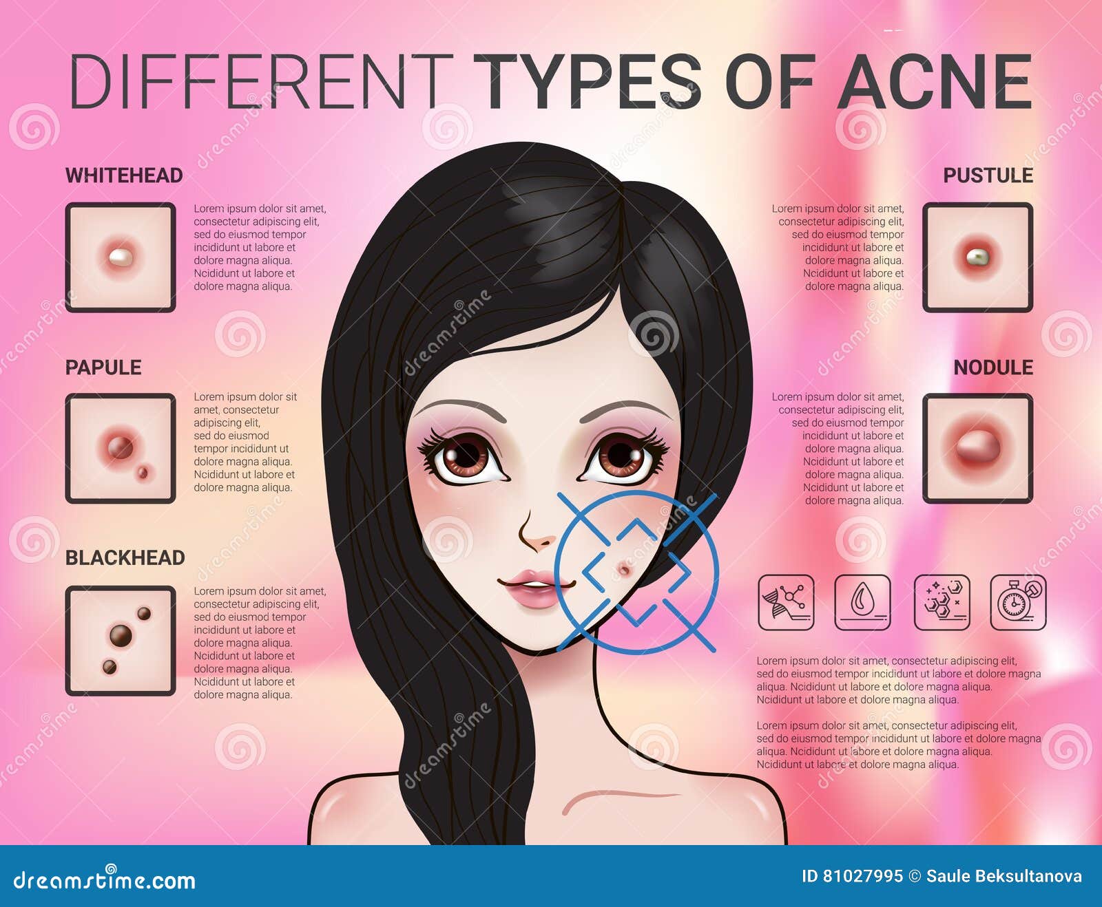 Infographics Of Skin Problems, The Causes Of Problem Skin, Types Of ...