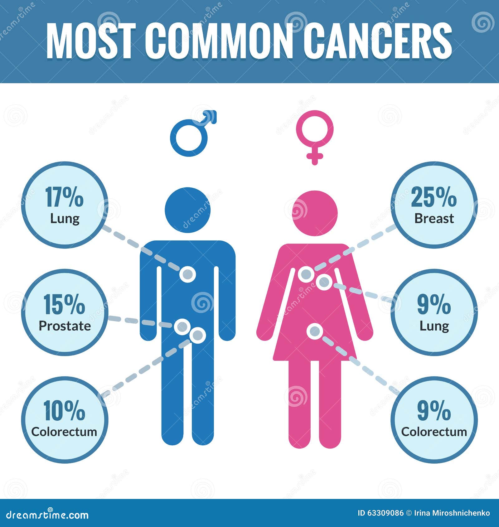 Infographics Masculino E Fêmea Do Câncer Ilustração Do Vetor