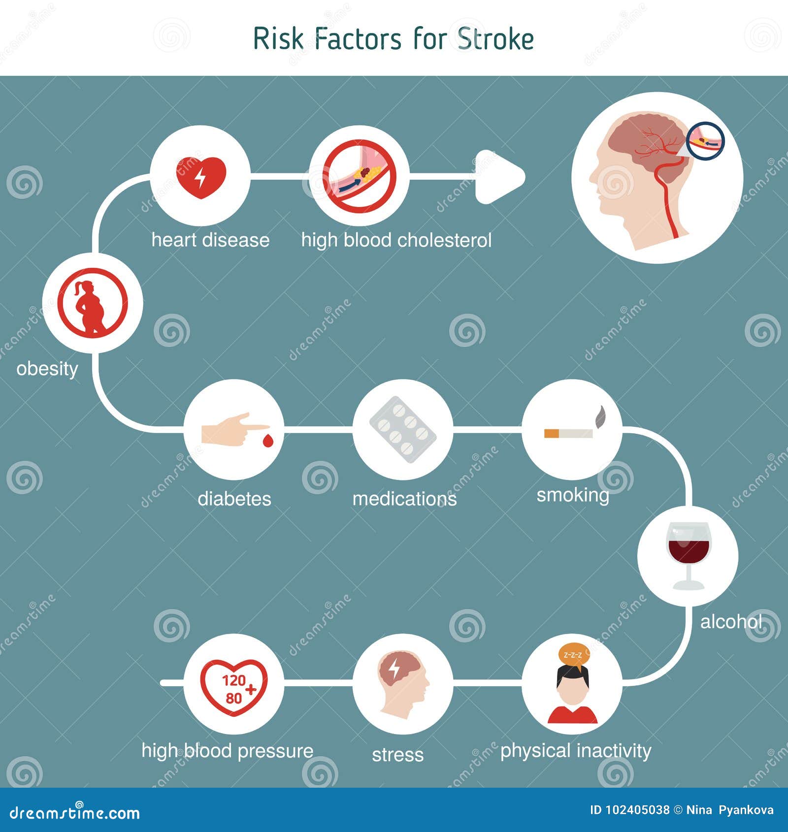 Infographics for stroke stock vector. Illustration of insult - 102405038