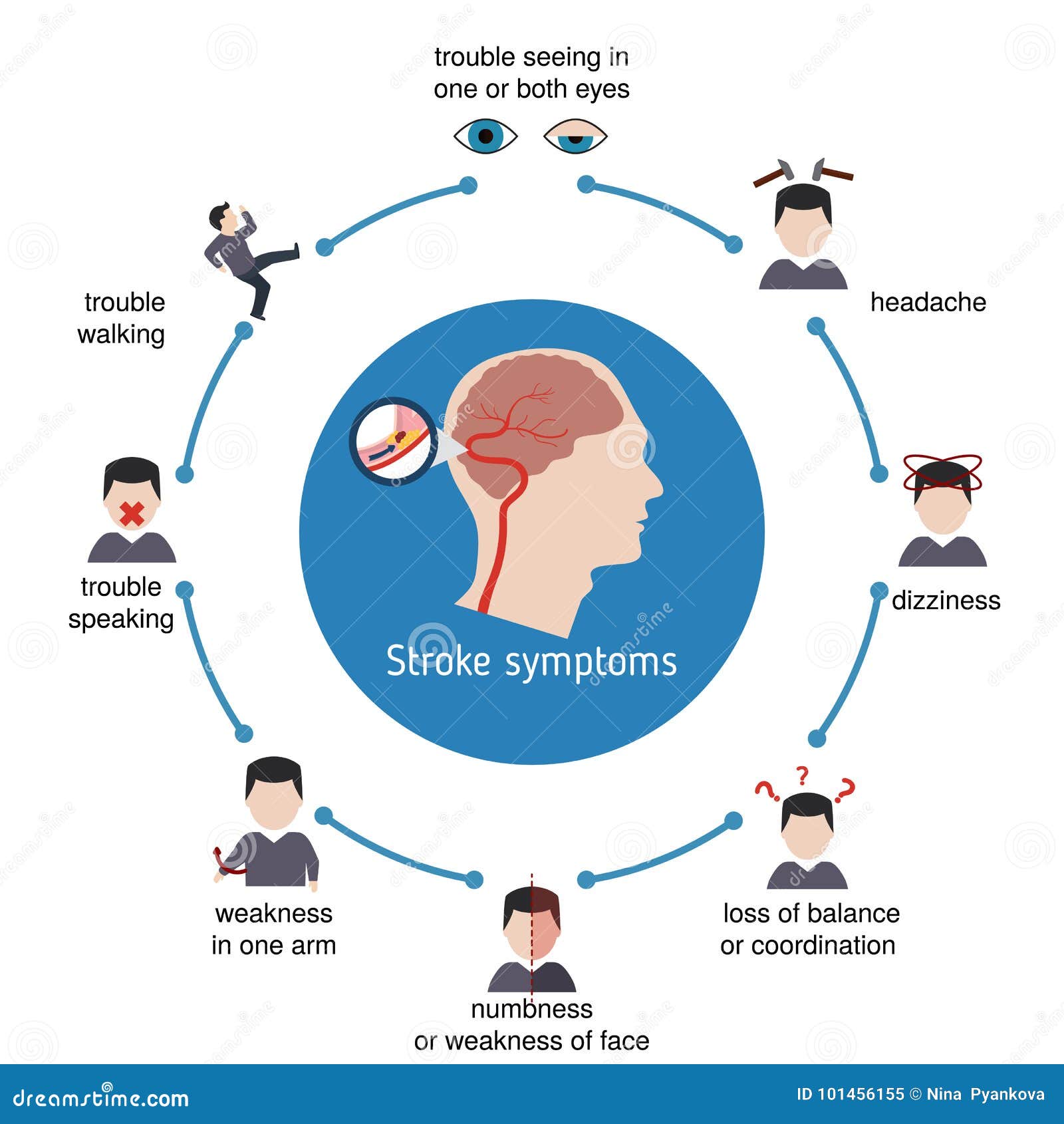 Infographics For Stroke Cartoon Vector | CartoonDealer.com #101453479