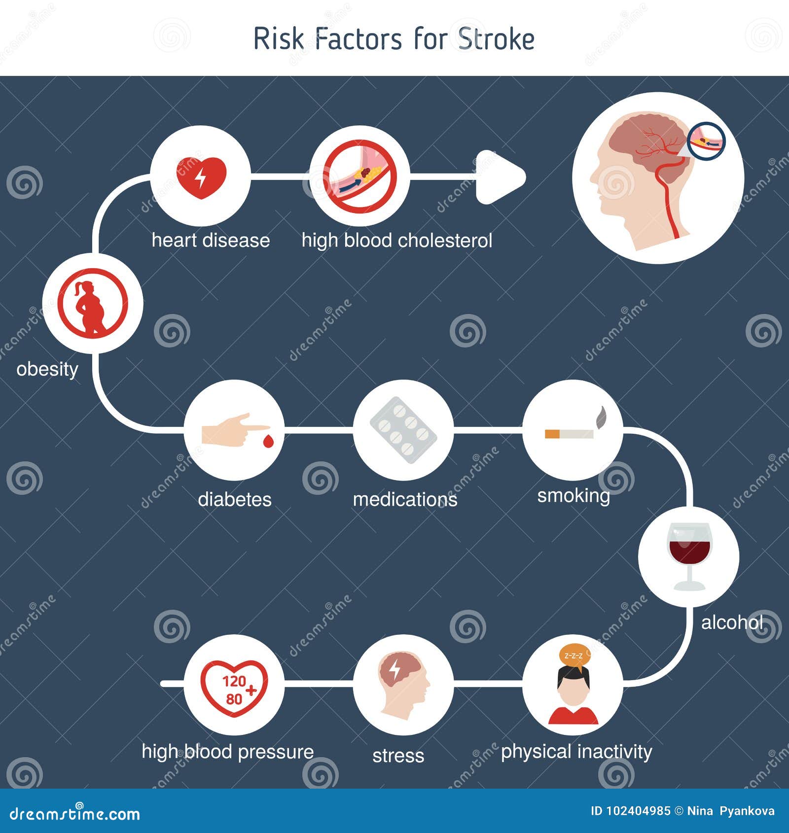 Infographics for stroke stock vector. Illustration of perfusion - 102404985