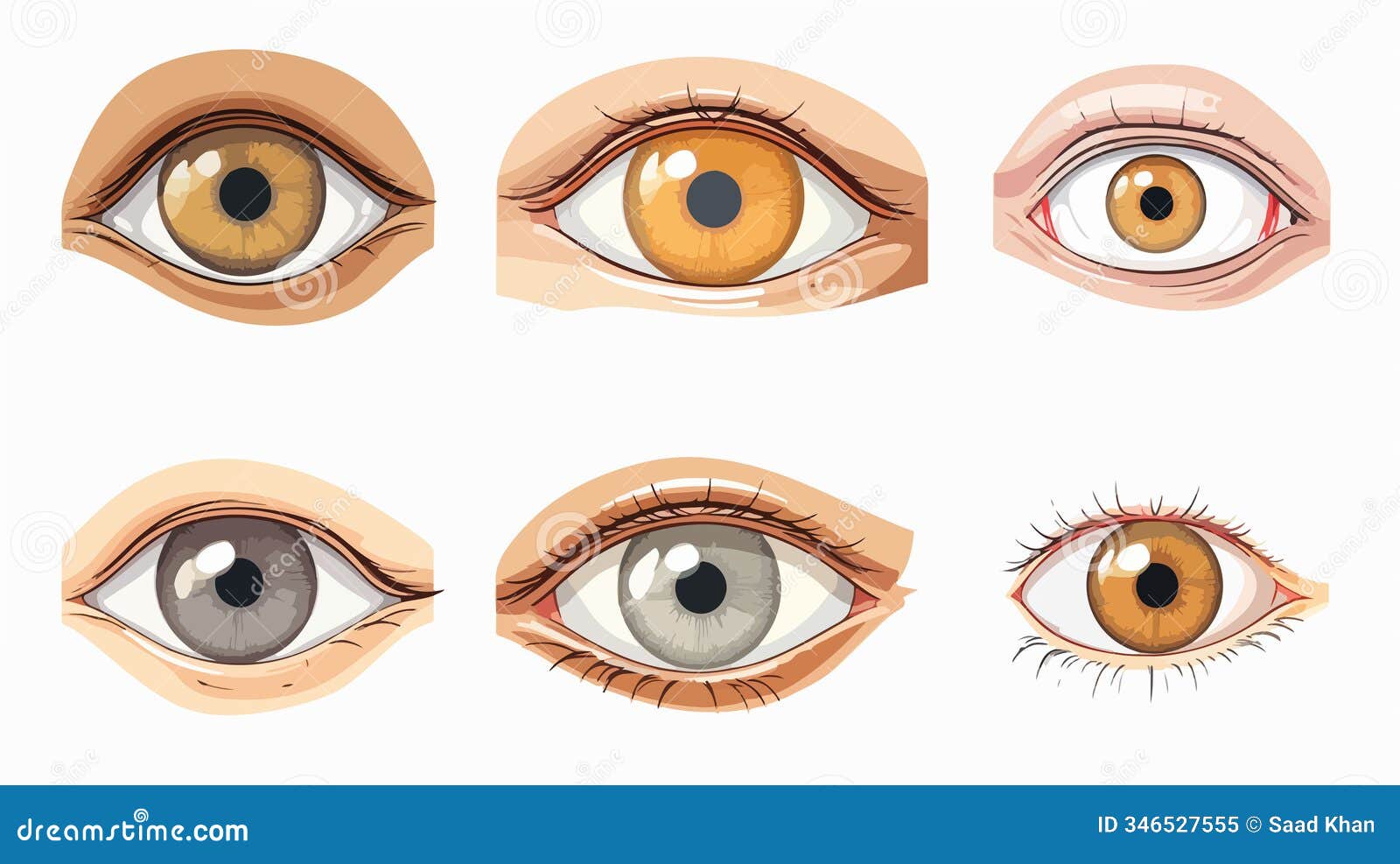 Informative Chart Detailing Myopia Hyperopia and Vision Health Stock ...