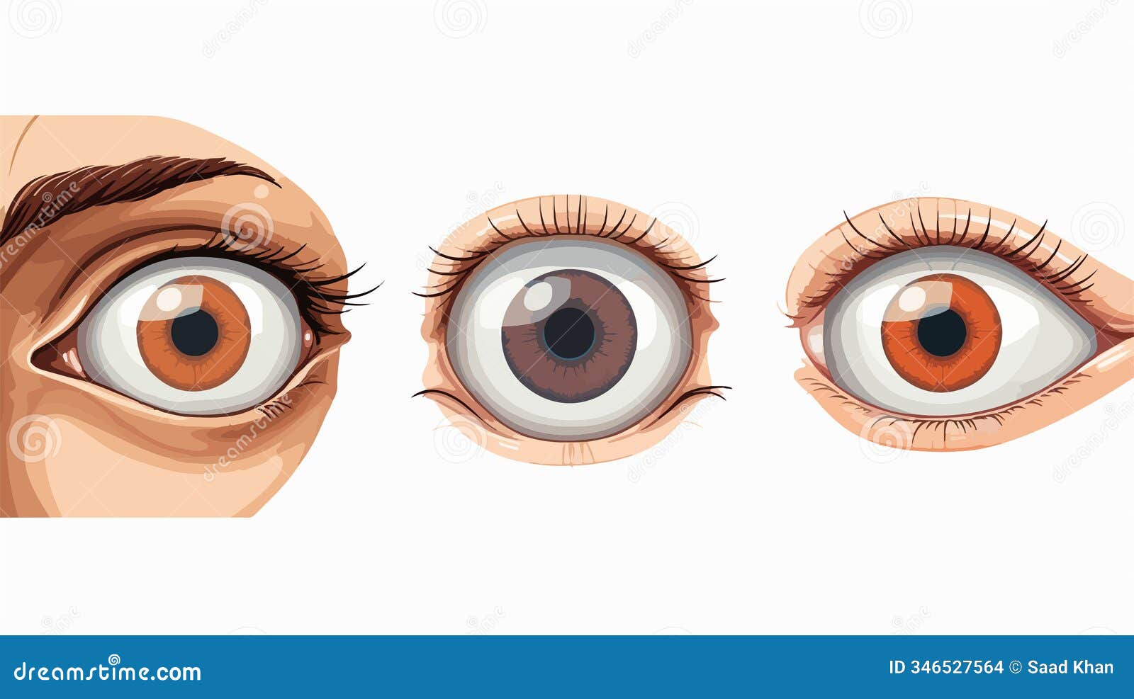 Informative Chart Detailing Myopia Hyperopia and Vision Health Stock ... Informative Chart Detailing Myopia Hyperopia and Vision Health Stock ...