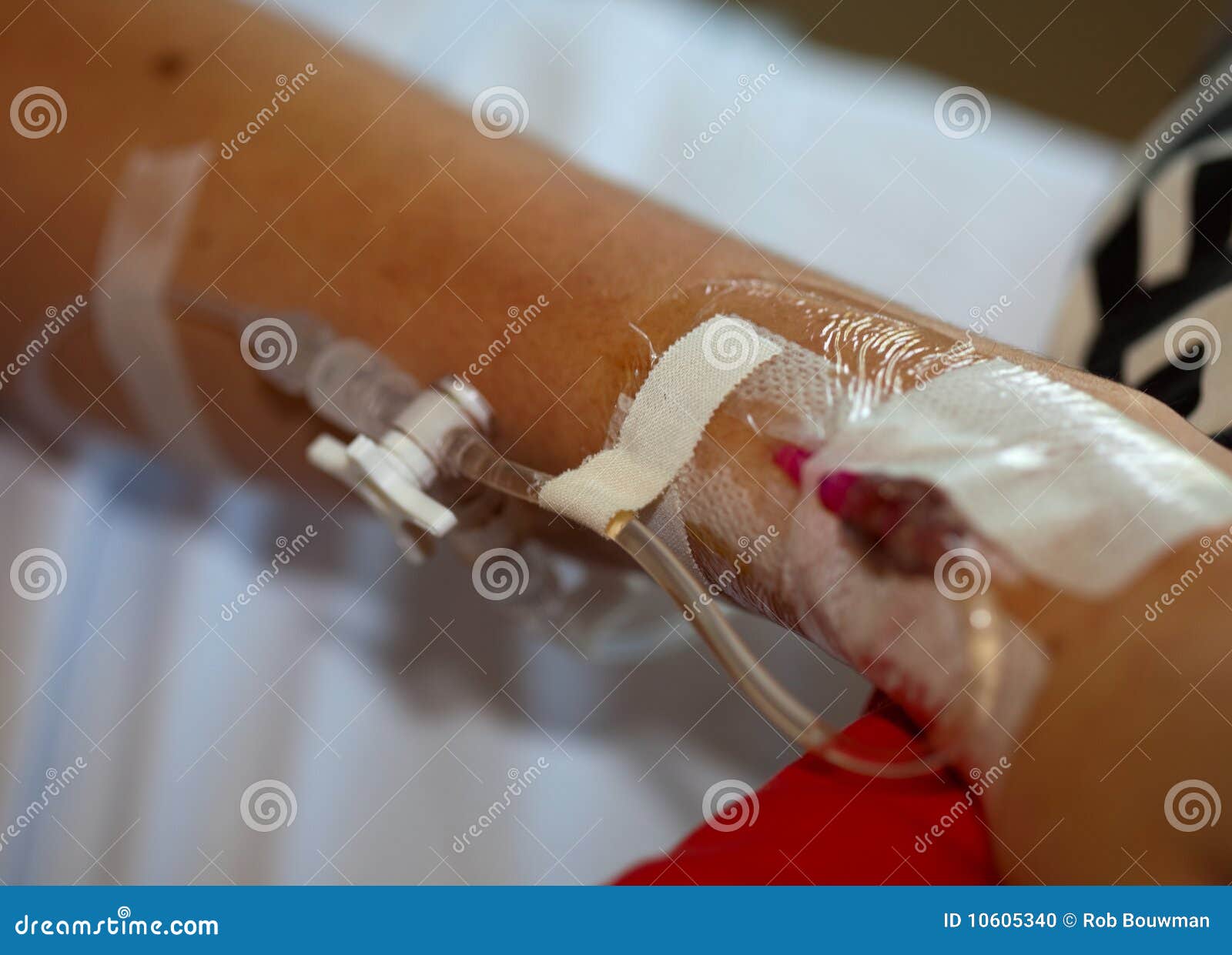 Infusion stock photo. Image of pharmaceutical, line, infusion - 10605340