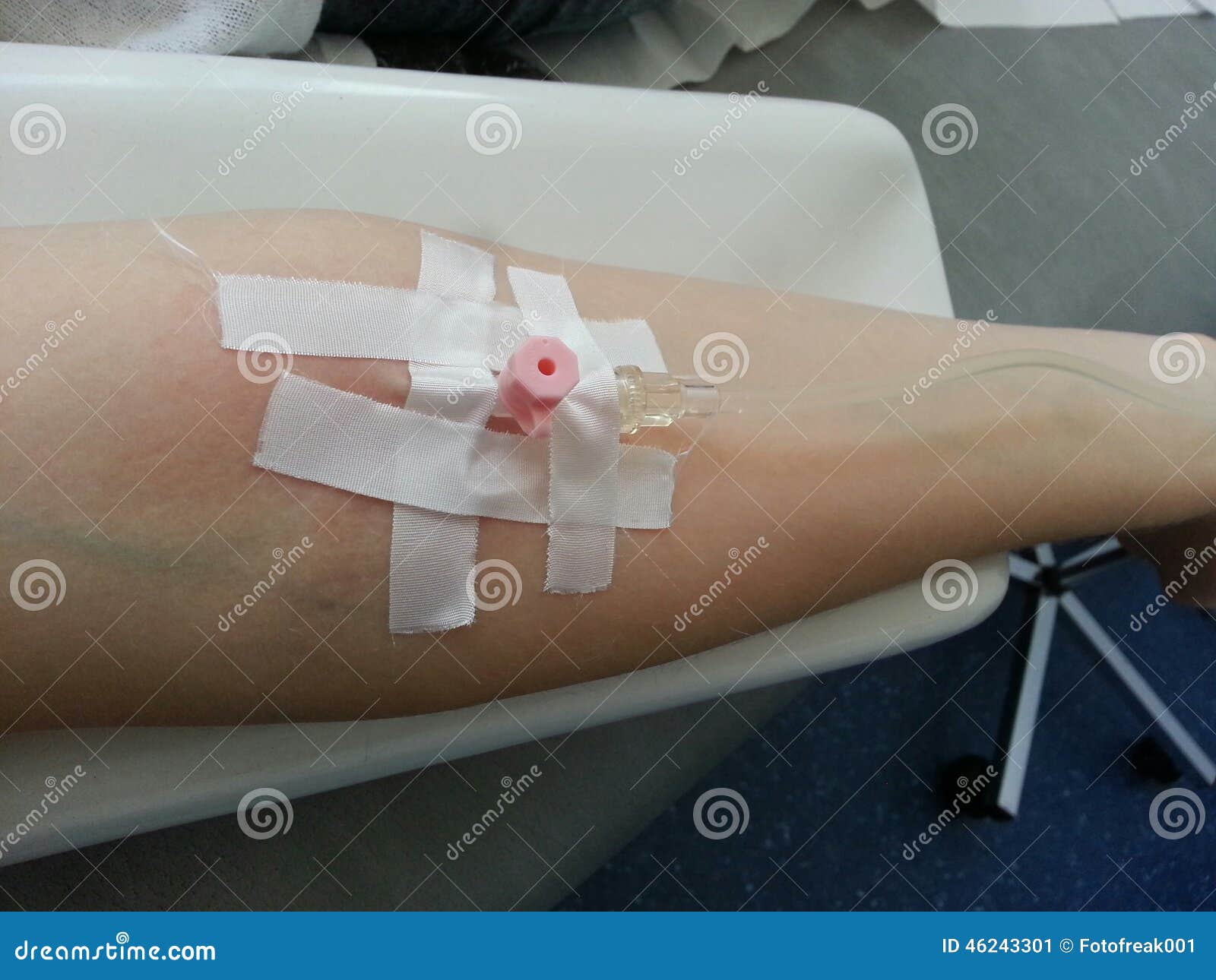 Infusion editorial photo. Image of needle, plaster, medicine - 46243301