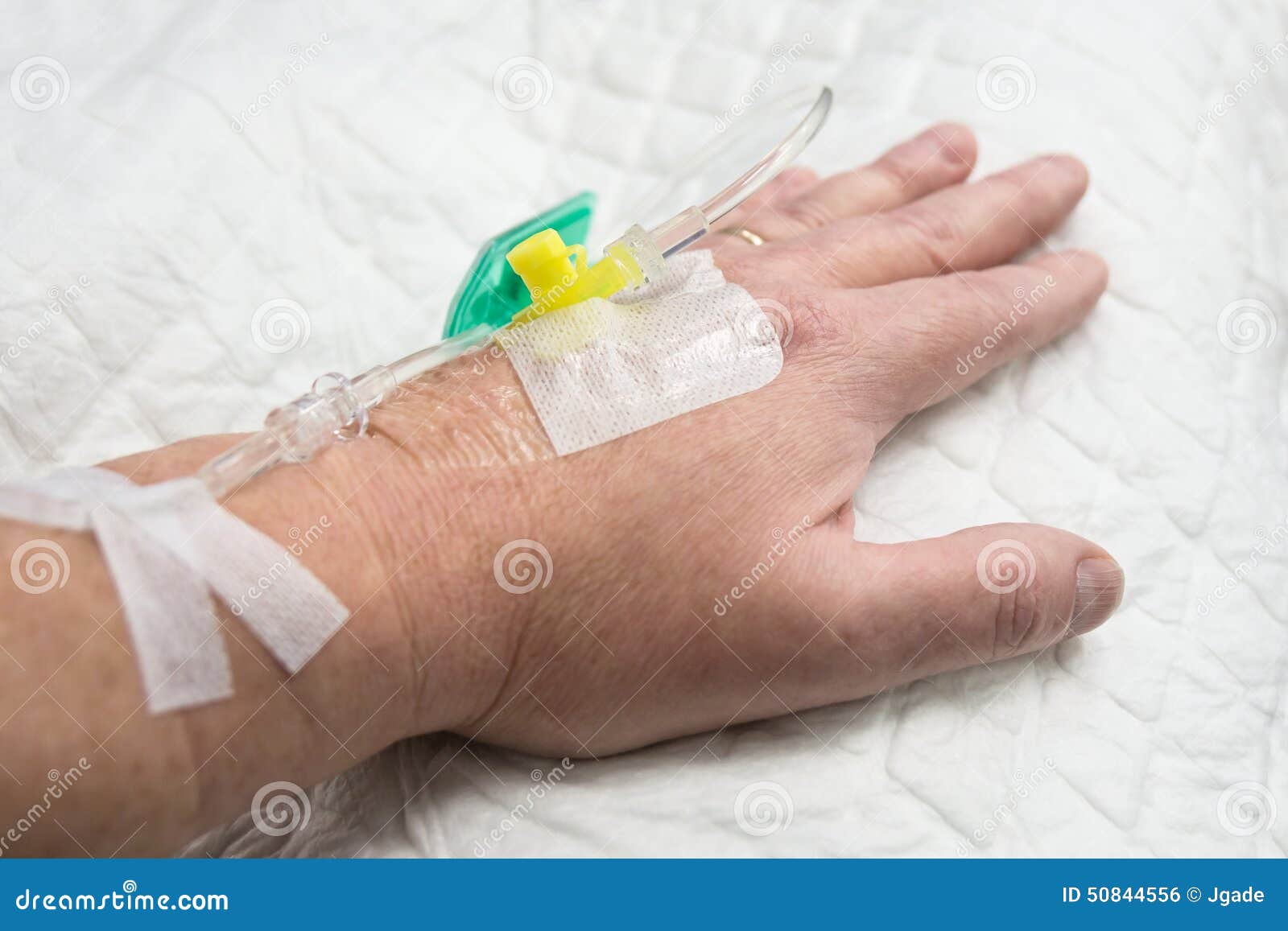 Infusion given into hand stock photo. Image of peripheral - 50844556