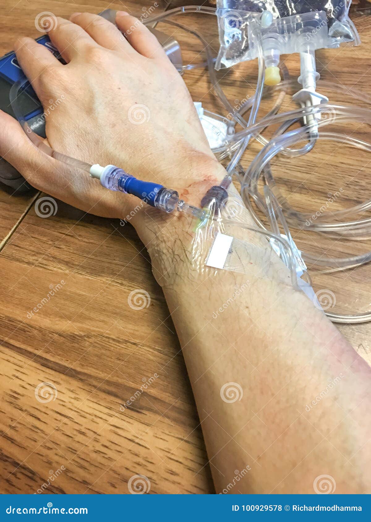 Infusion or IV injection. stock photo. Image of blood - 100929578