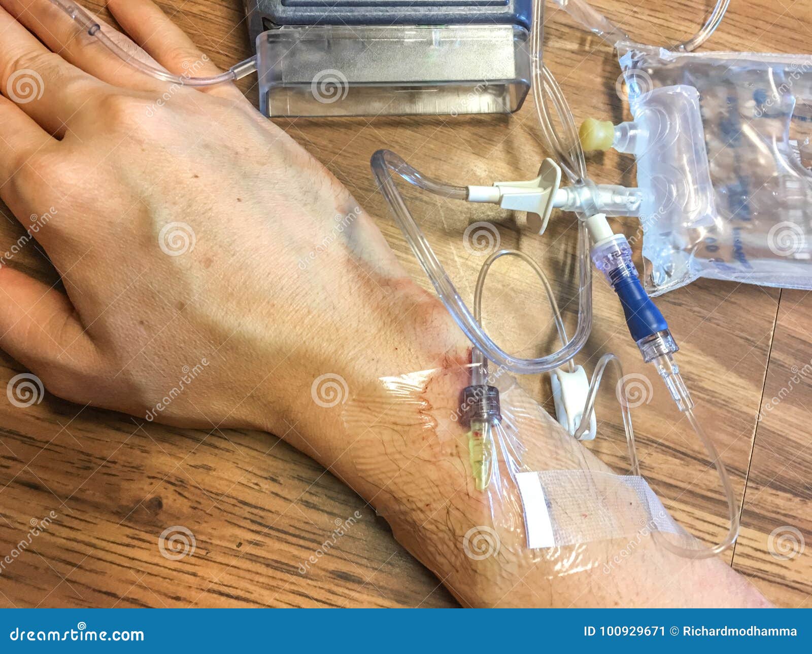 Infusion or IV injection. stock image. Image of cure - 100929671