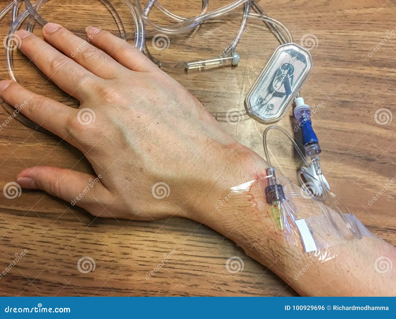 Infusion or IV injection. stock photo. Image of illness - 100929696