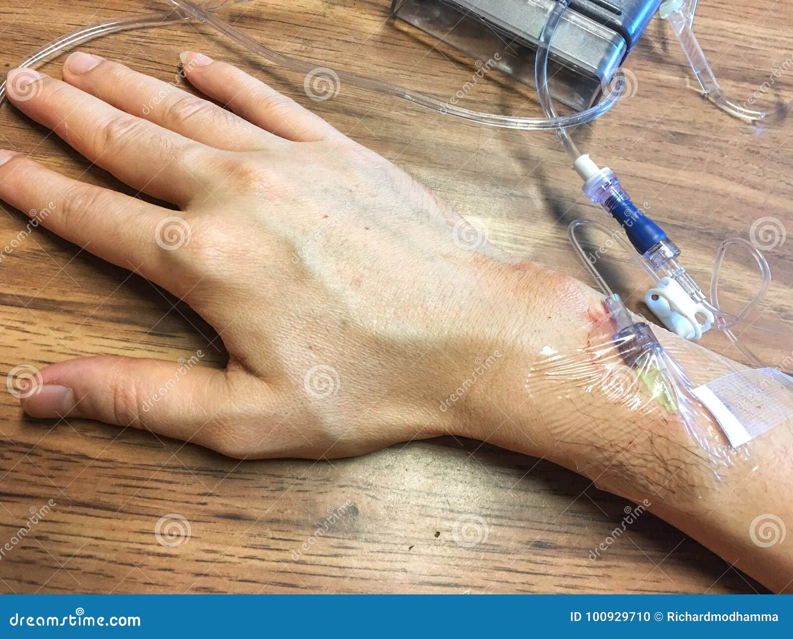 Infusion or IV injection. stock photo. Image of illness - 100929710