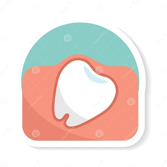 Ingrown Tooth. Vector Illustration Decorative Design Stock Vector ...