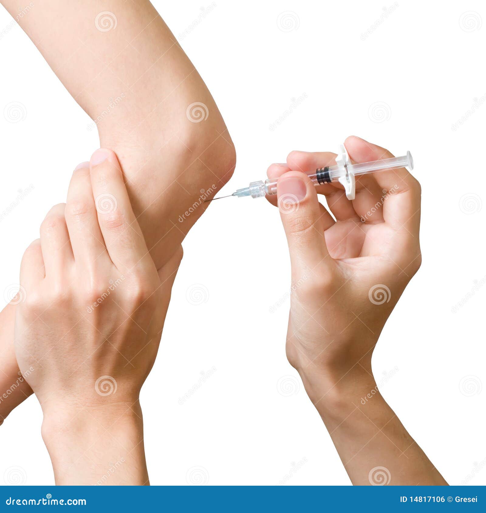 Injeção Intra-articular. foto de stock. Imagem de injetar - 14817106