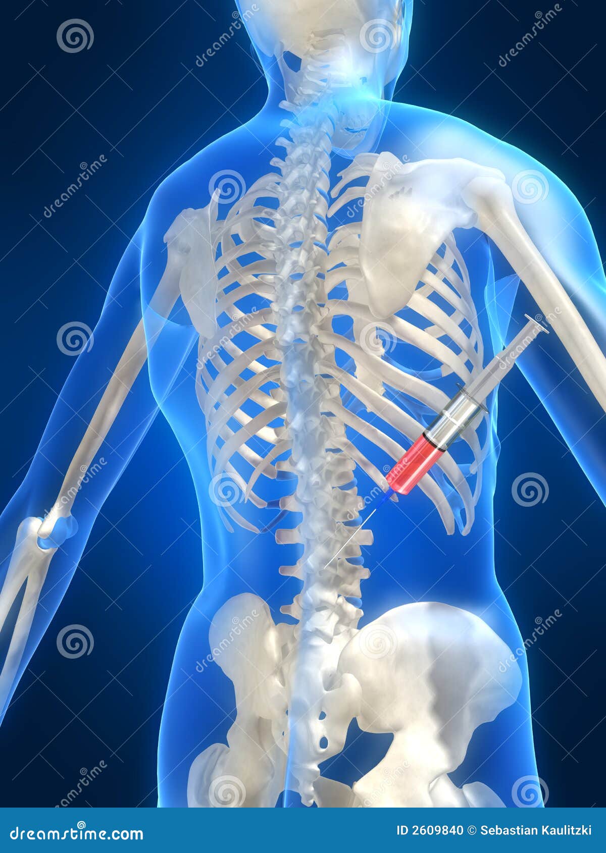 Injection stock illustration. Illustration of medical - 2609840
