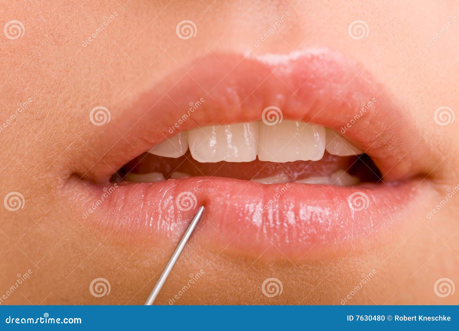 Lip Piercing Needle