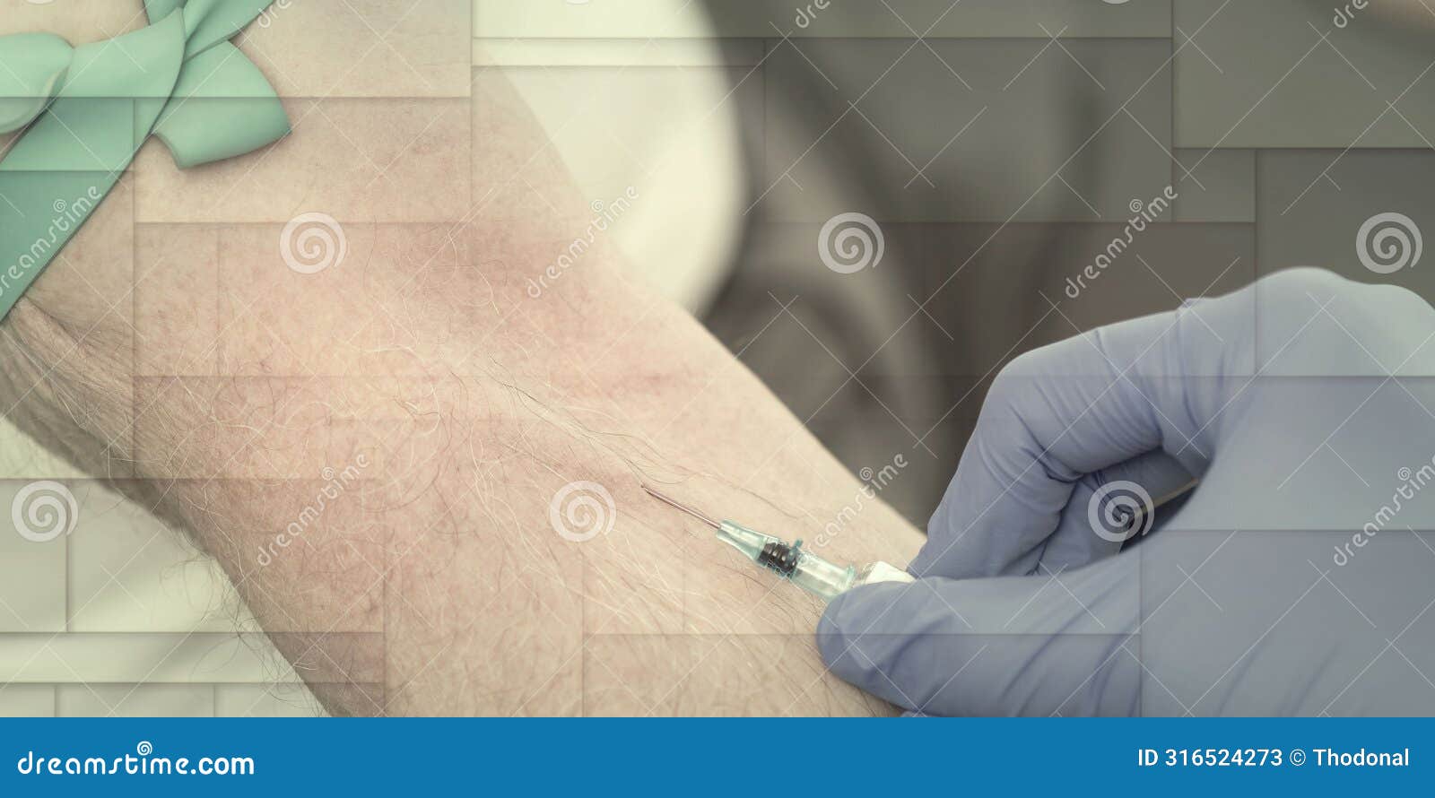 Injection Of A Catheter In The Arm, Geometric Pattern Royalty-Free ...